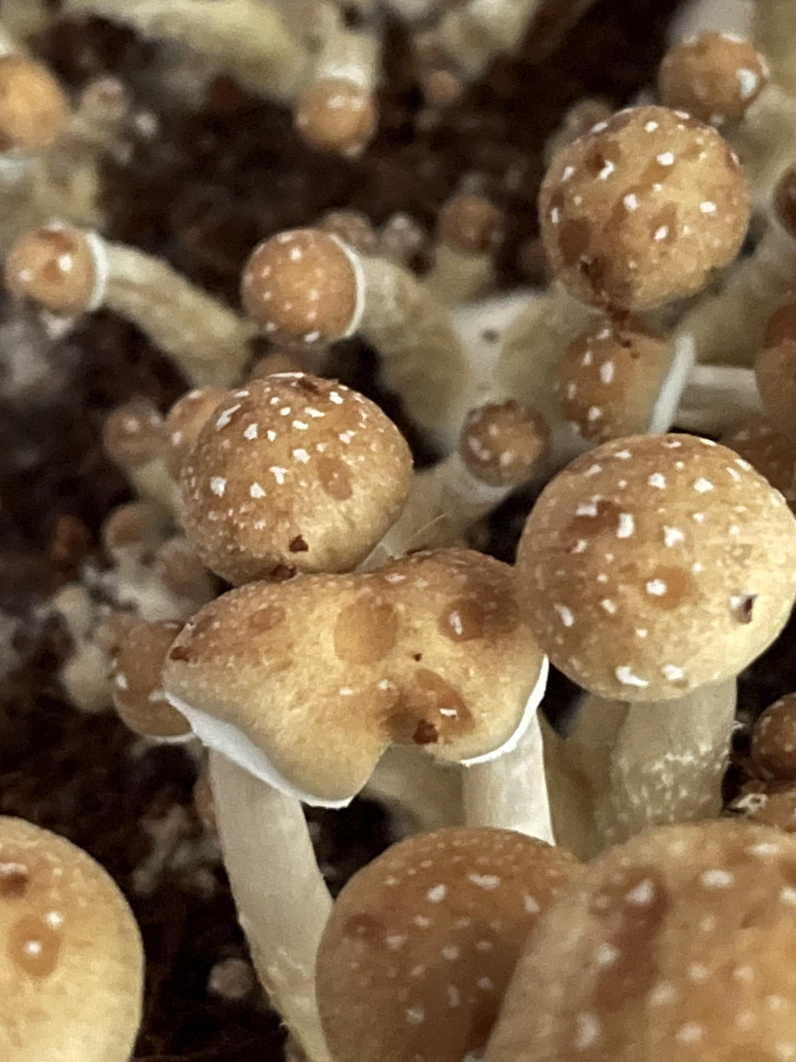 Conjoined twins | Scrolller