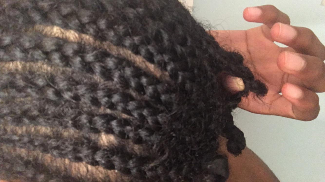 Is this normal with cornrows | Scrolller