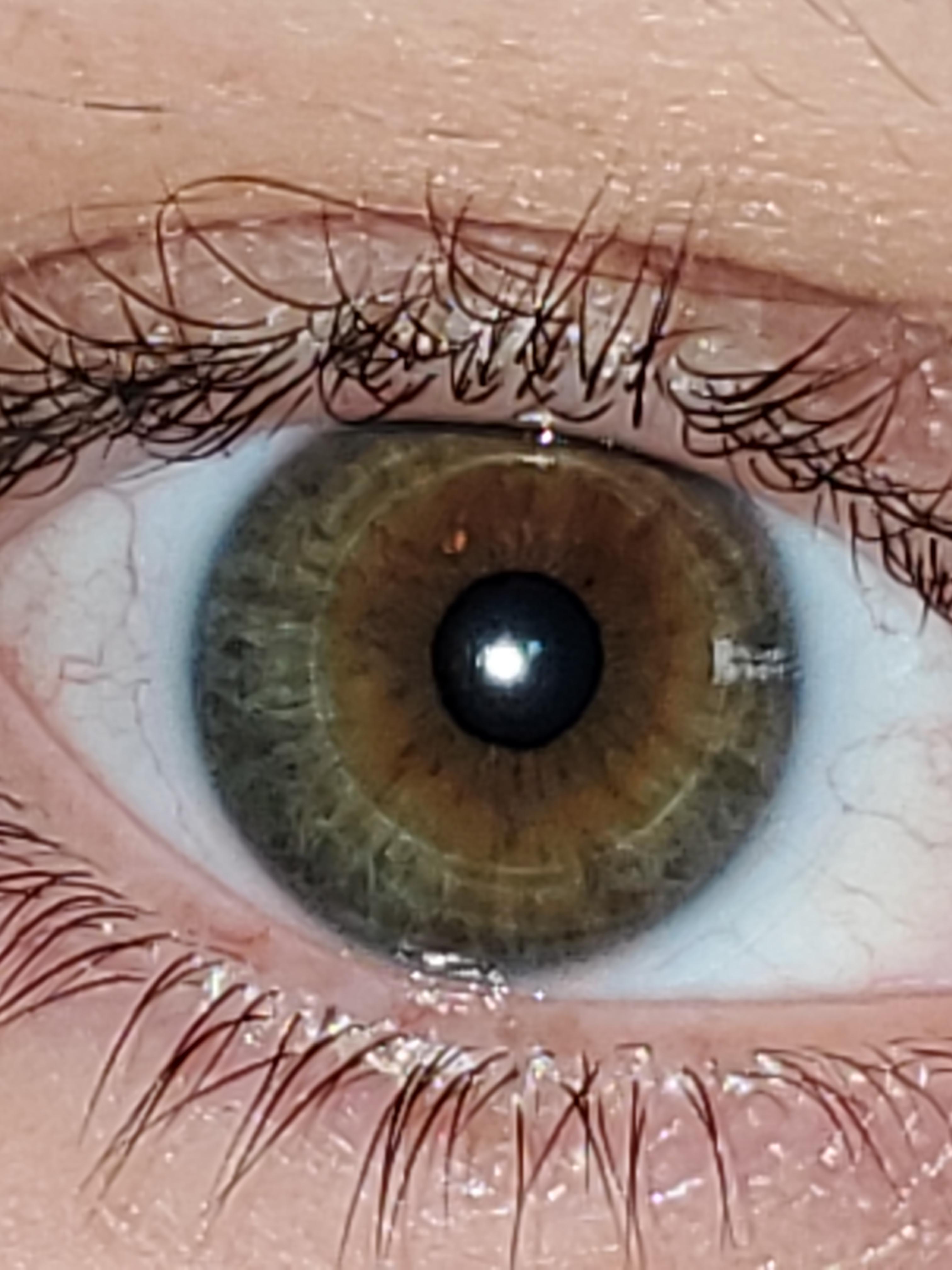 What color are my eyes? Is this hazel? | Scrolller
