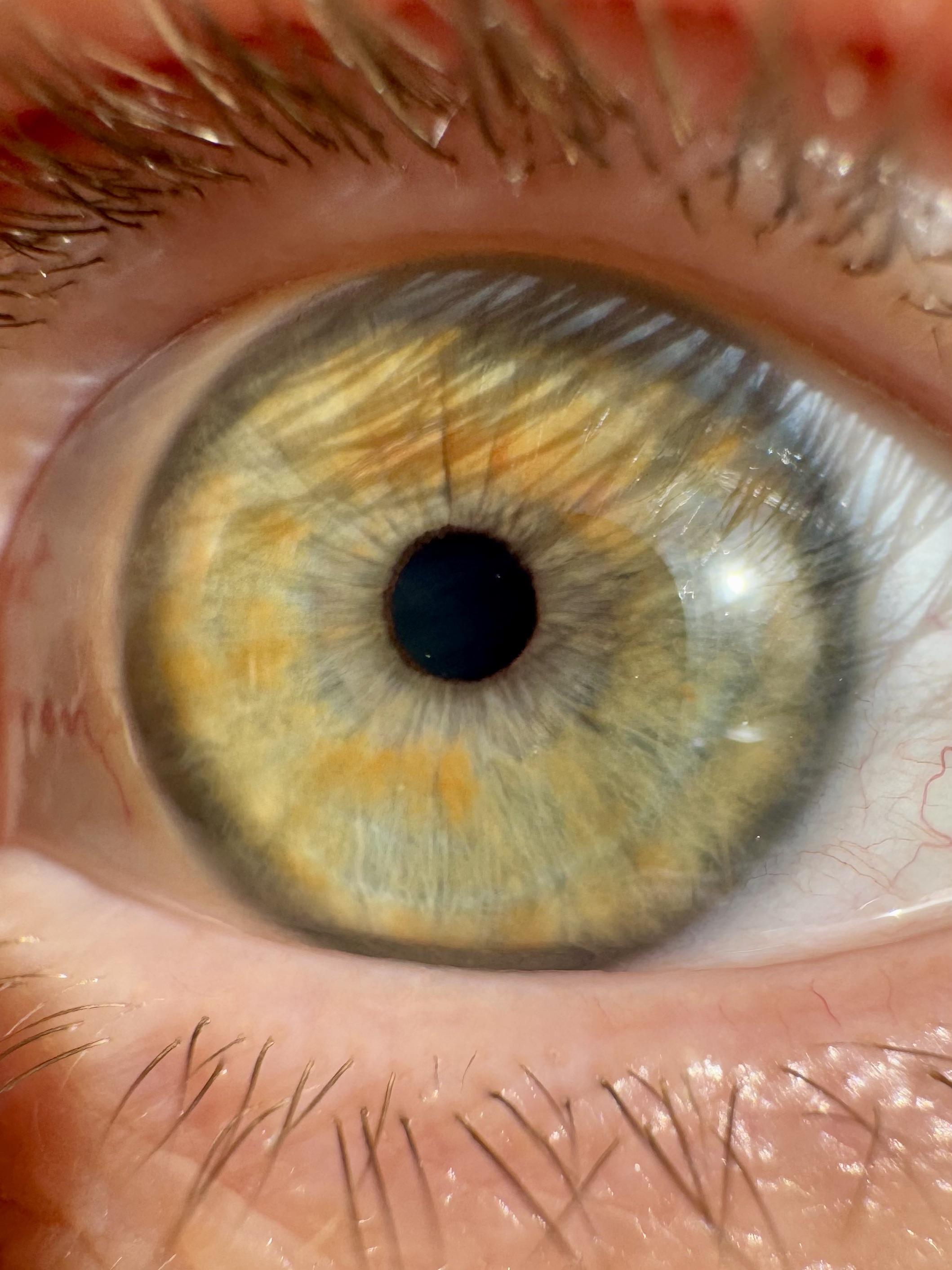 Green? Hazel? | Scrolller