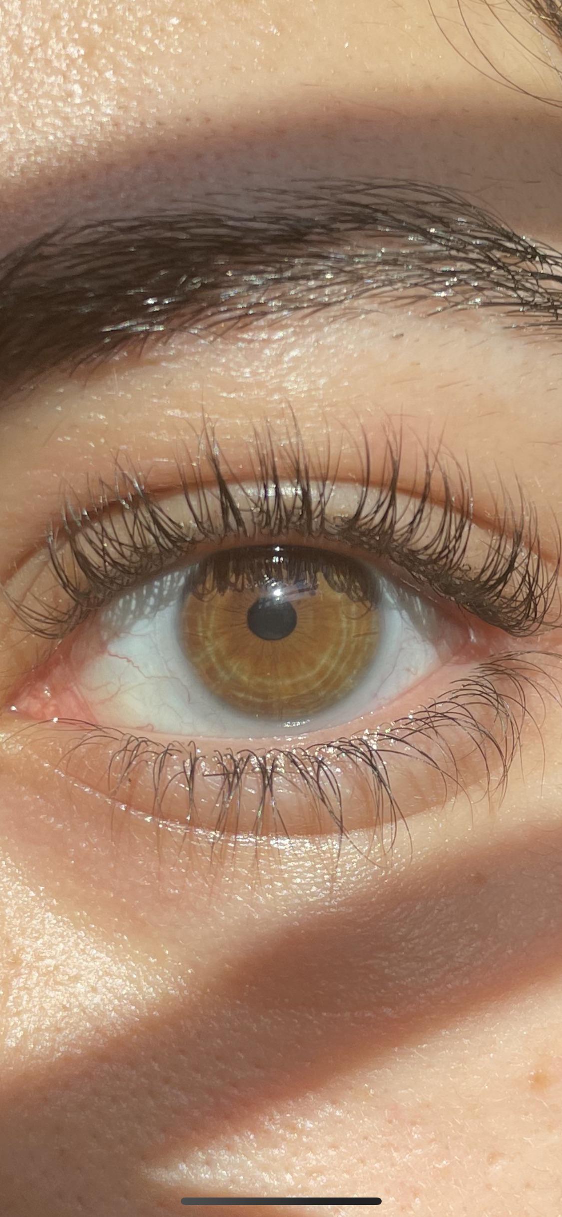 Are these rings normal? | Scrolller