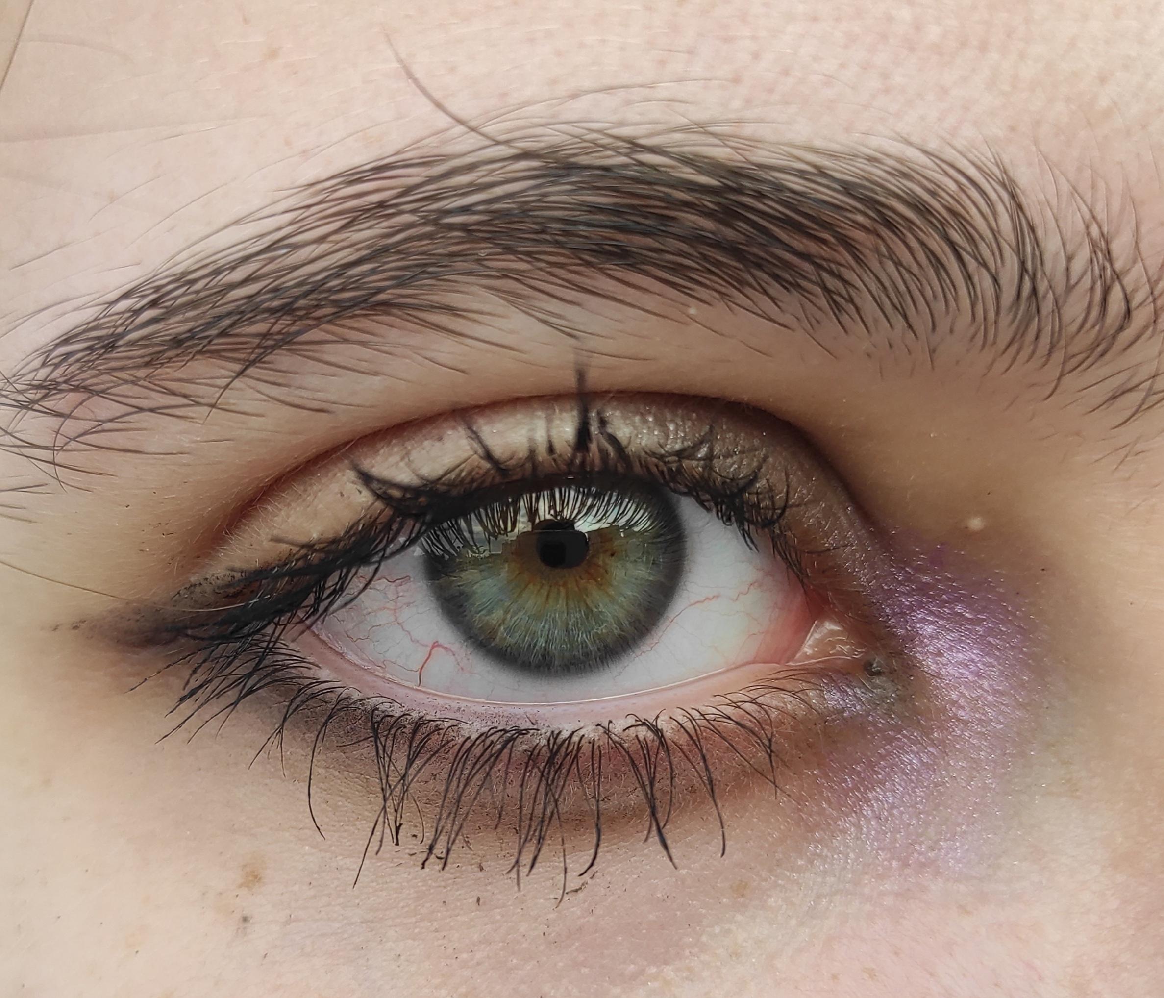 I have no idea what colour my eyes are, and also have funky veins. | Scrolller