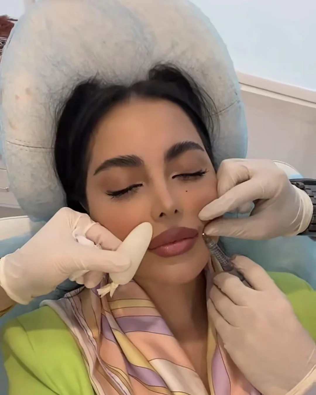 an Influencer having botox& filler injections with full makeup on 🤡 | Scrolller