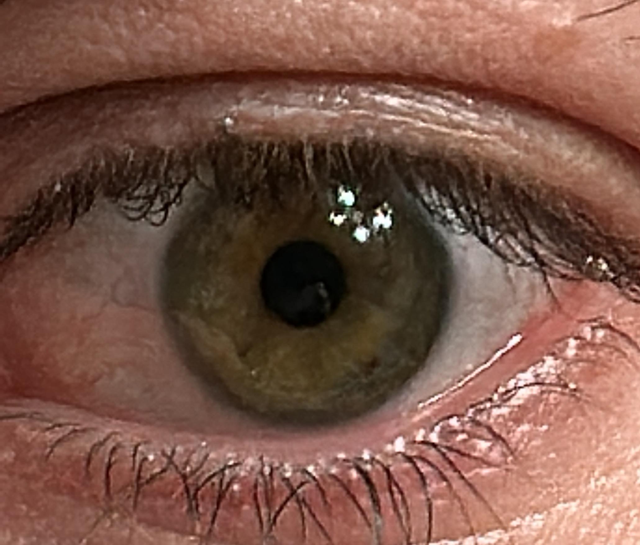 Green or hazel | Scrolller