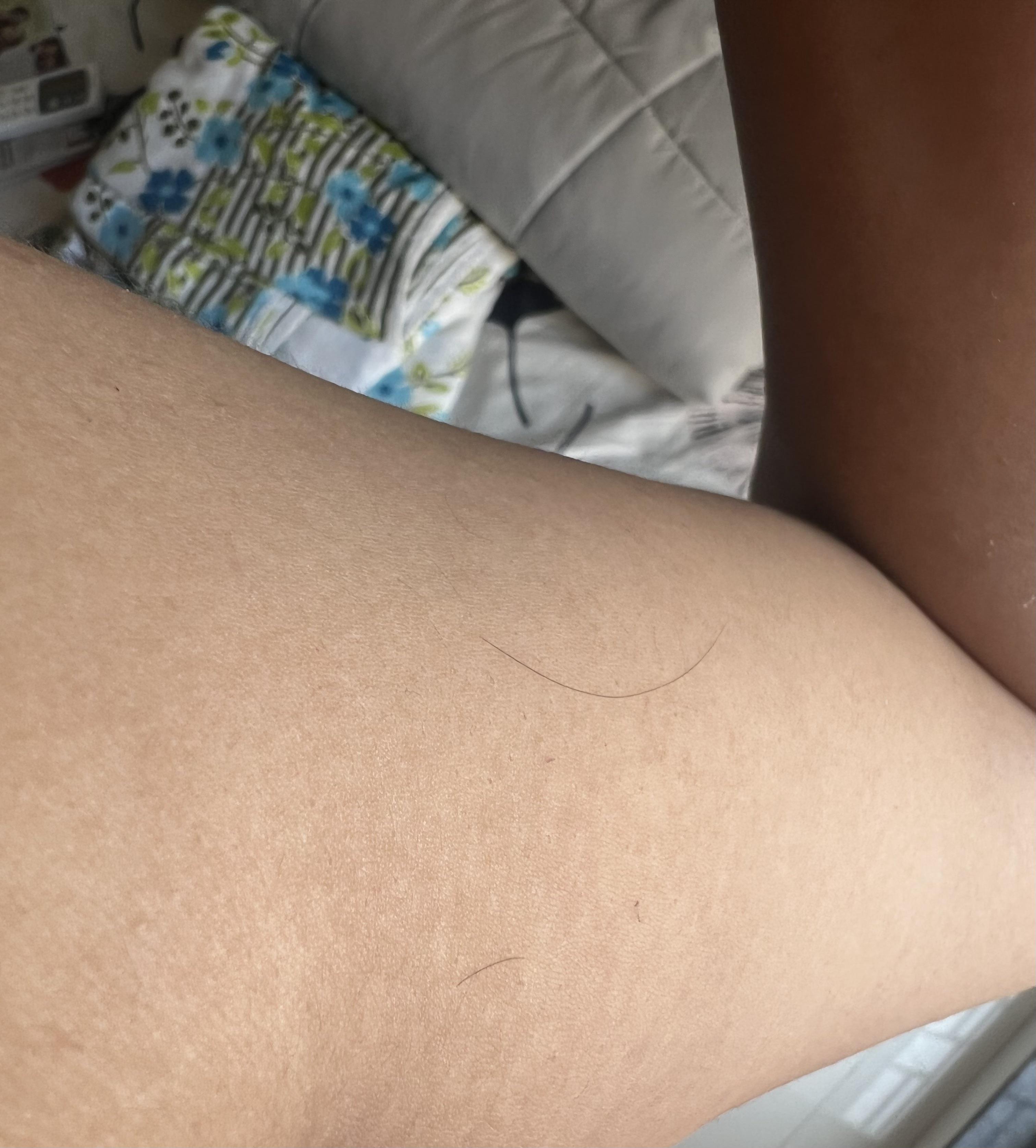 Pigmentation & marks | Scrolller