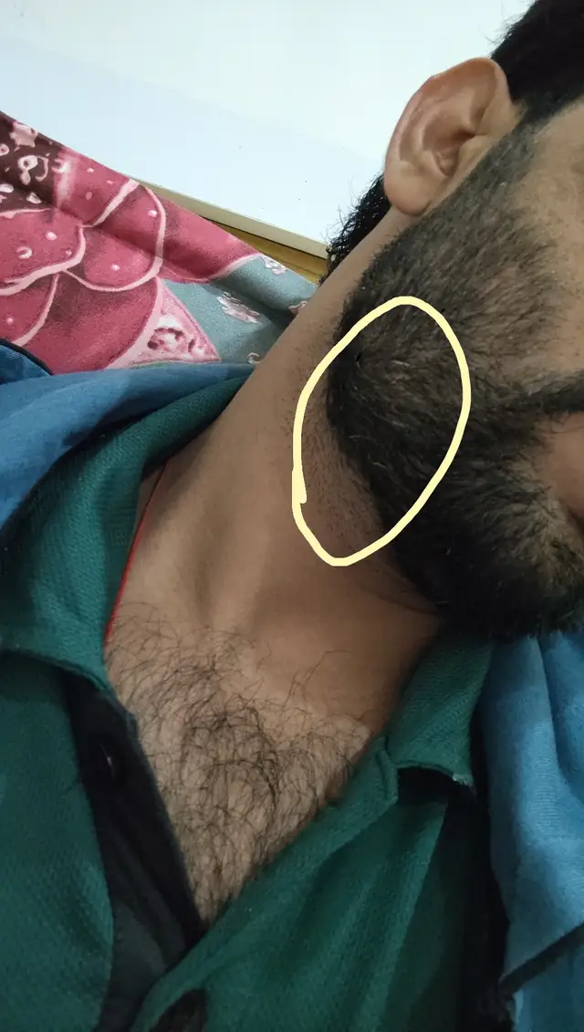 Any solutions to white beard hairs ? | Scrolller