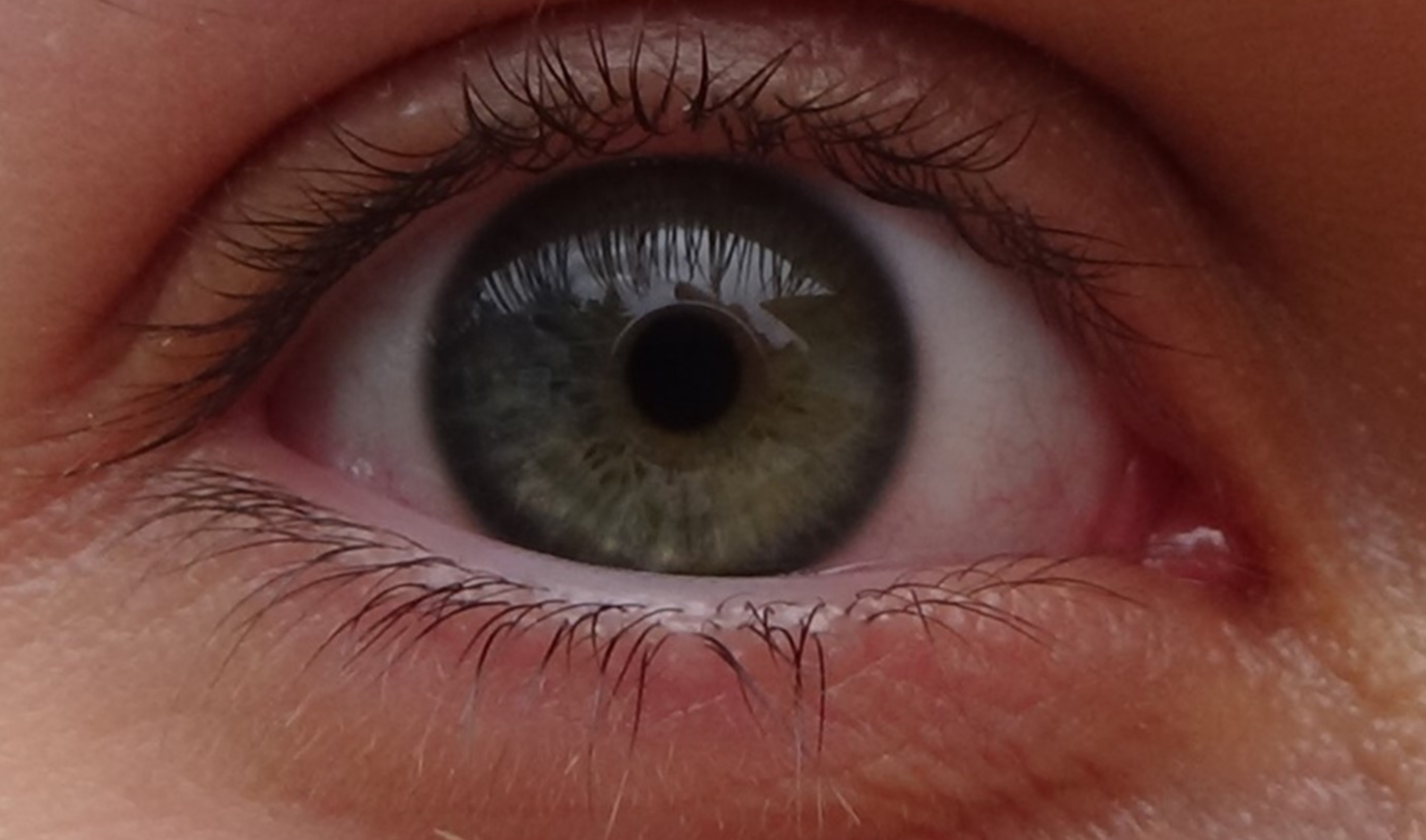 Green or hazel or something else? | Scrolller