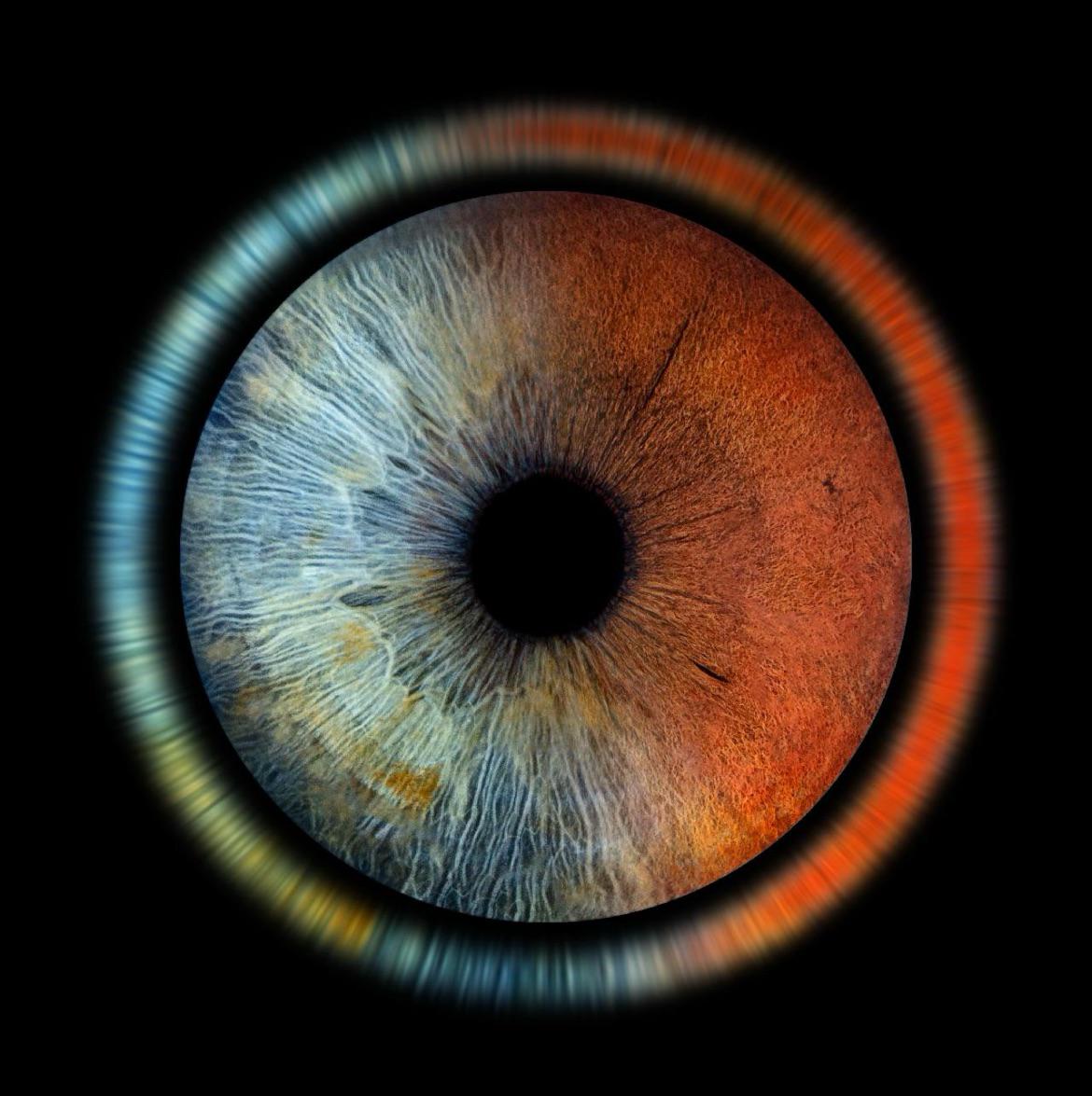 Me and my partner got professional iris pictures! | Scrolller