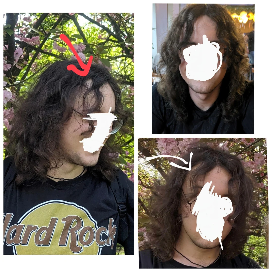 My problem | Scrolller