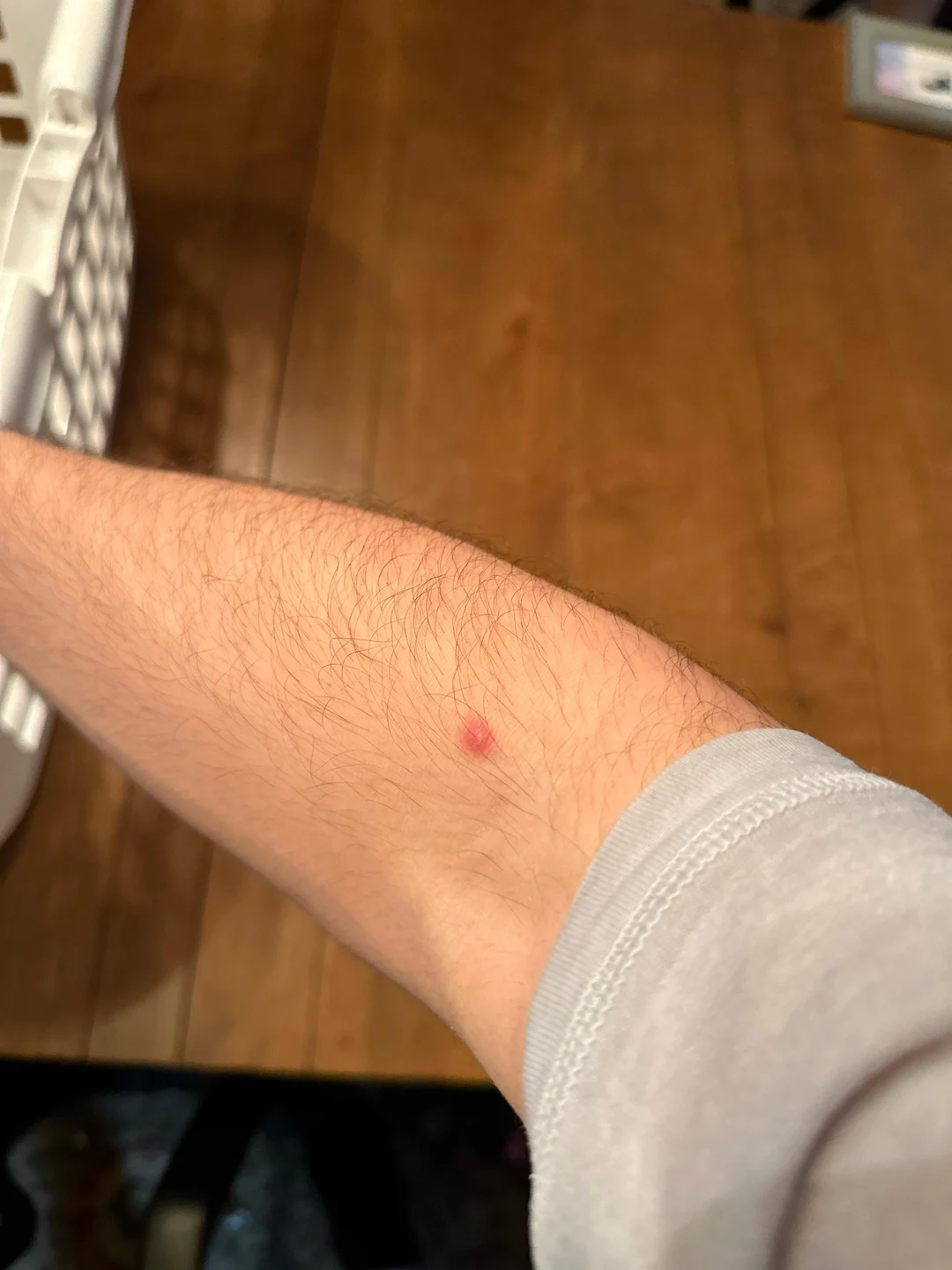 Skin funk or just weird zit? | Scrolller