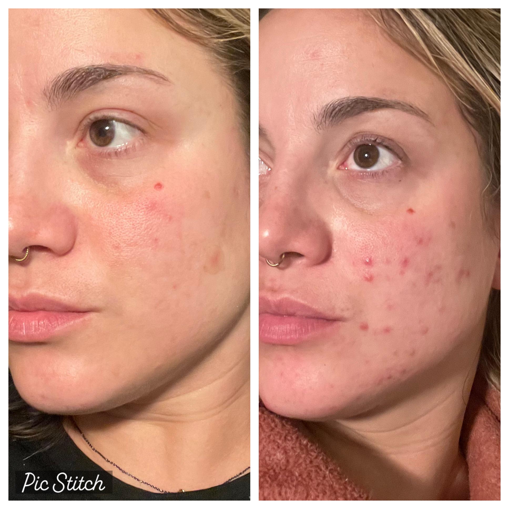 Bbl forever clear | Scrolller