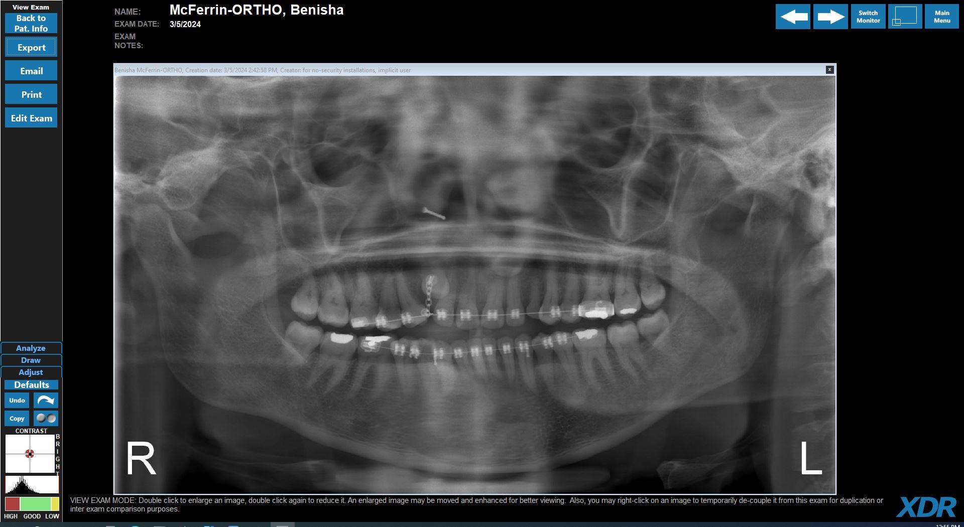 Got a xray last week | Scrolller