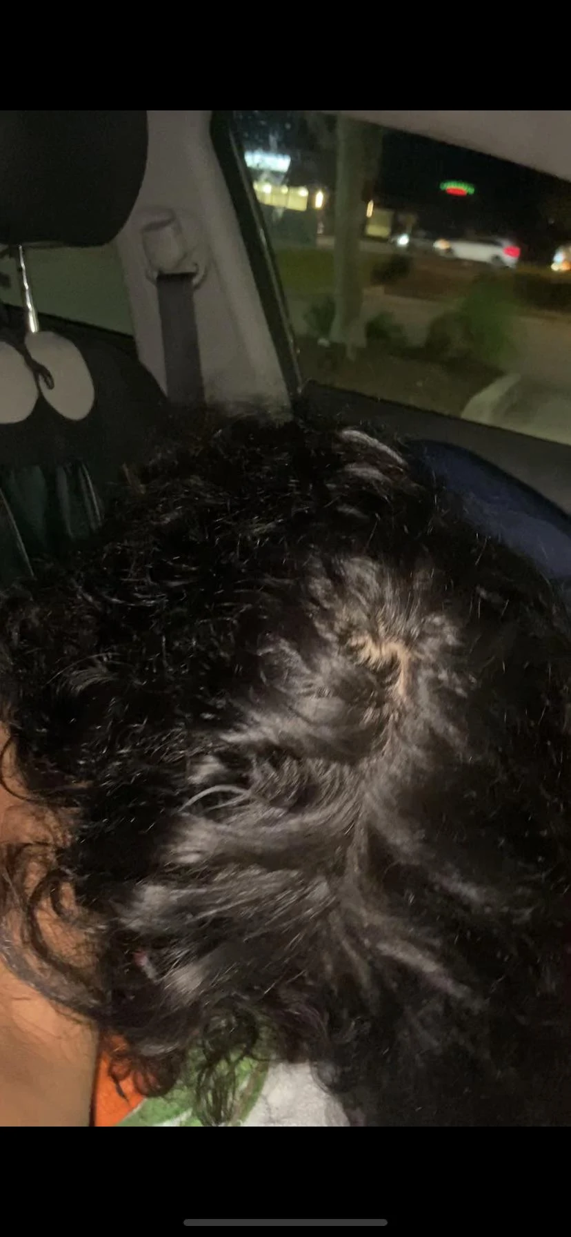 Am I going bald? | Scrolller