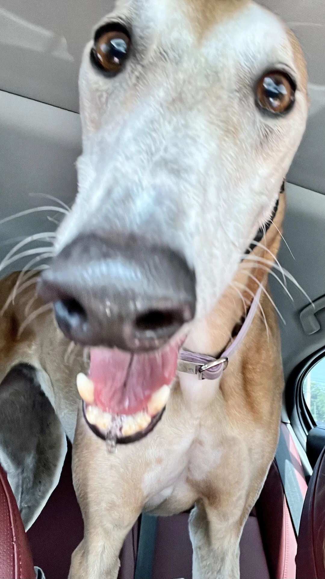 This girl finally got her teeth cleaned!! | Scrolller