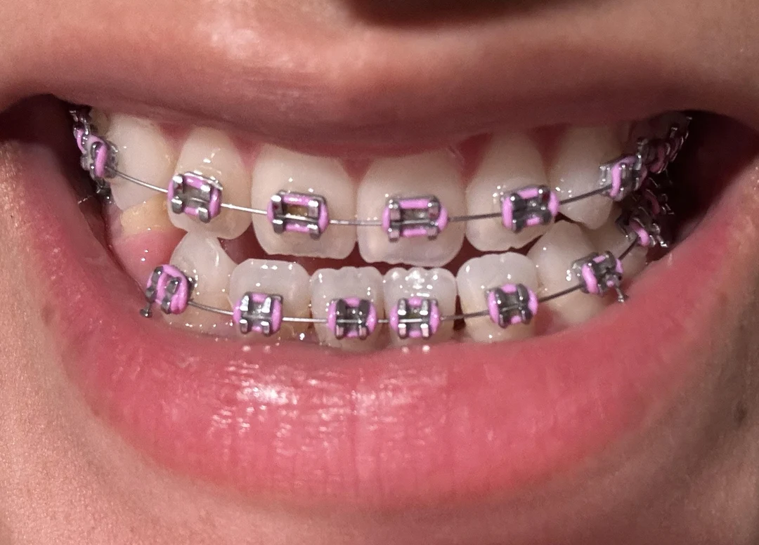 Second Appointment | Scrolller