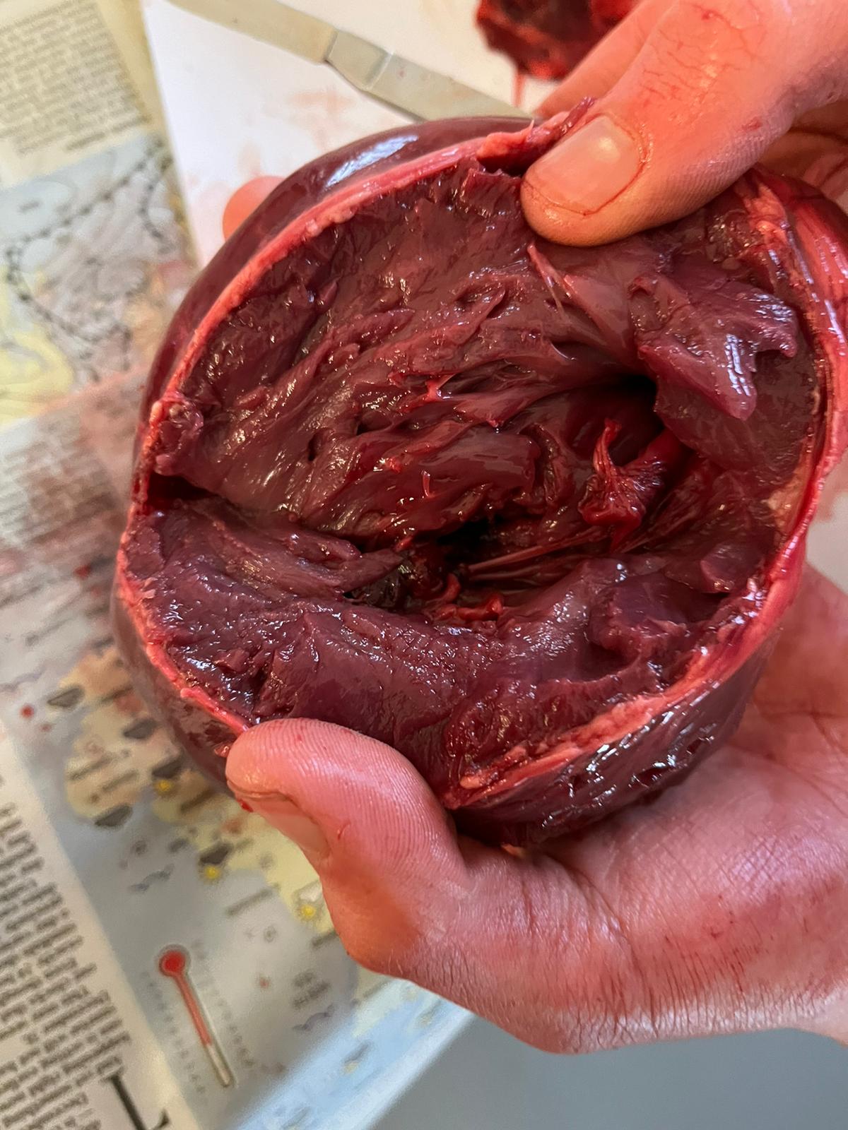 Heart dissection yesterday | Scrolller