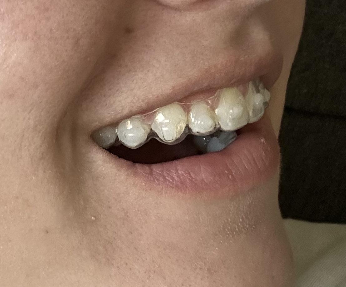 Tracking | Scrolller