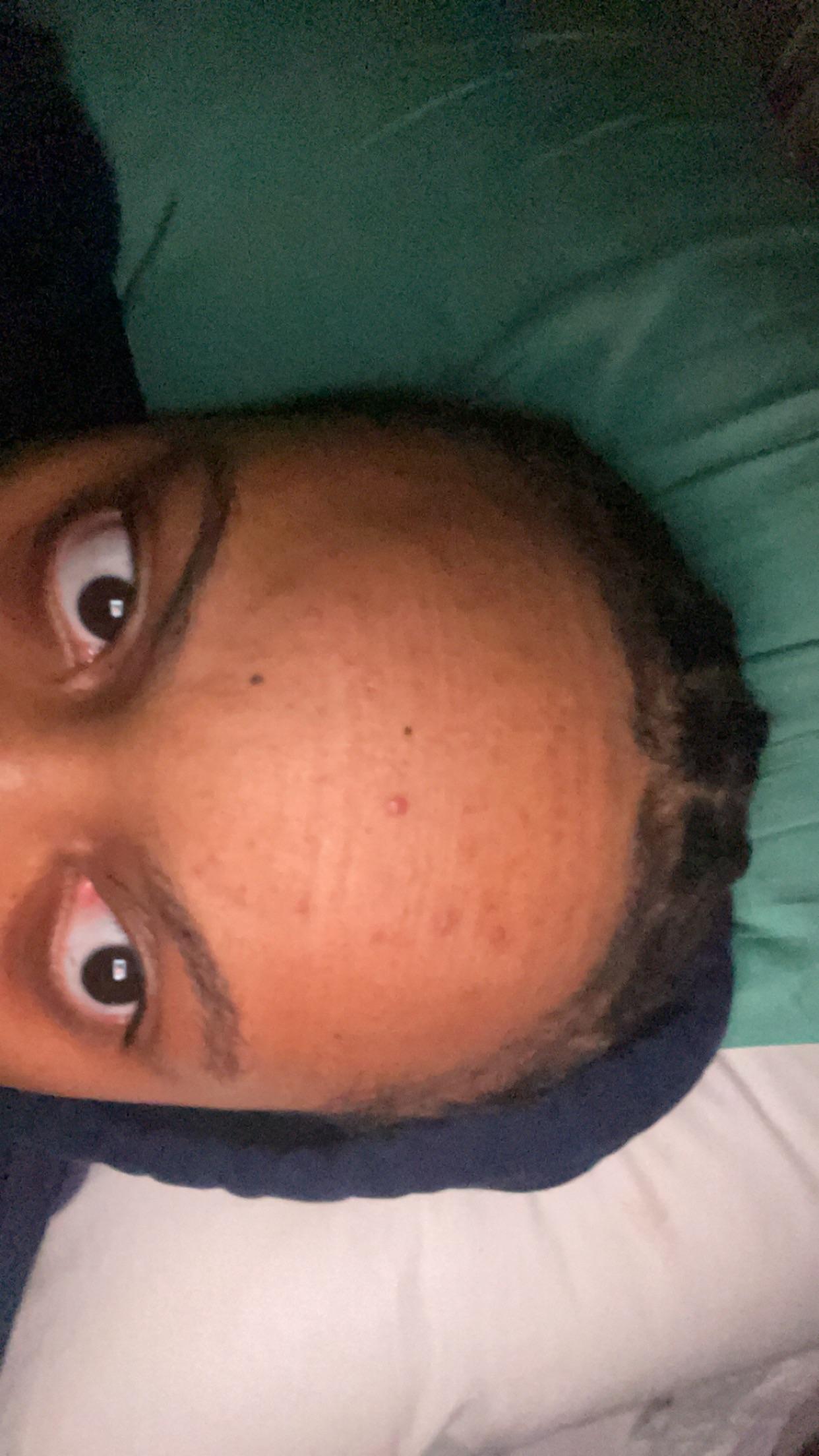 Discover more like BlackHair: Is it normal for cornrows to do this? and Related Content | Scrolller