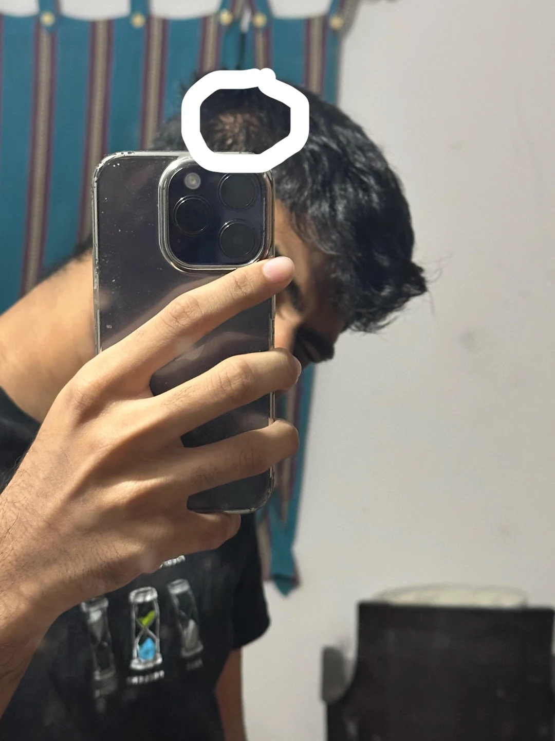 I’m a 19 year old guy is this normal ? | Scrolller