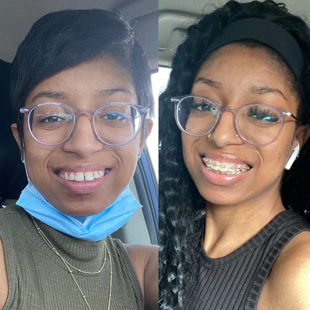 Before and pic on the right is from July! | Scrolller