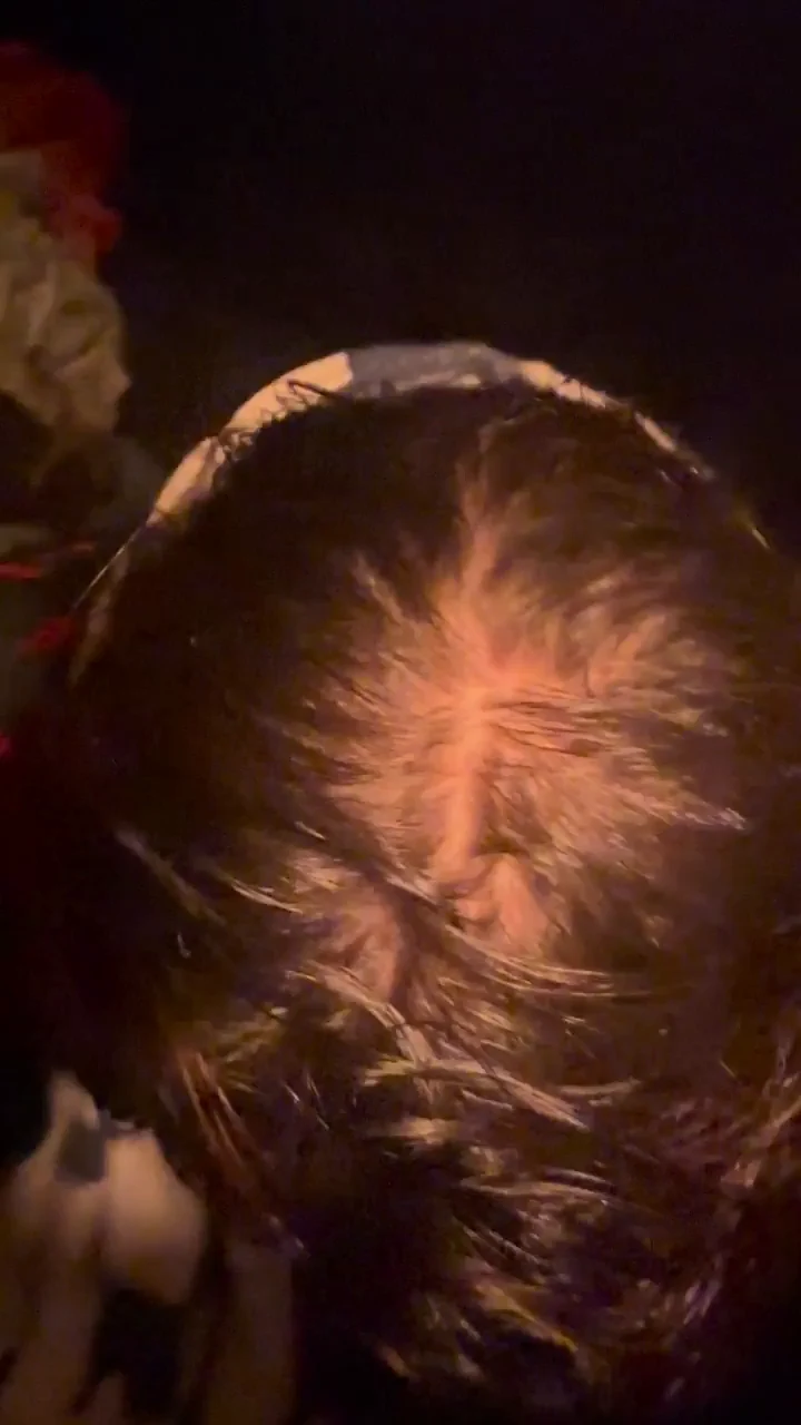 Would you say that im balding? | Scrolller