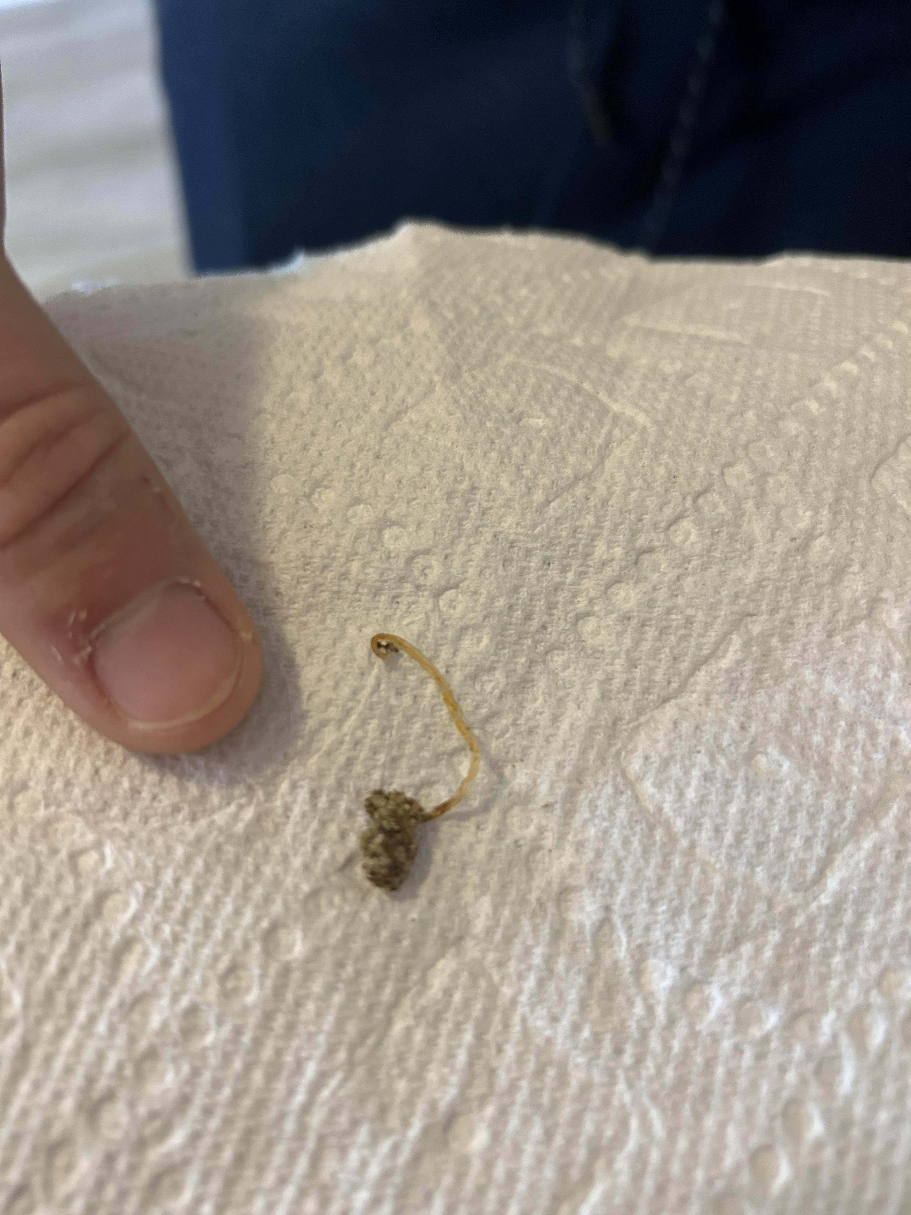 Possible worms? | Scrolller