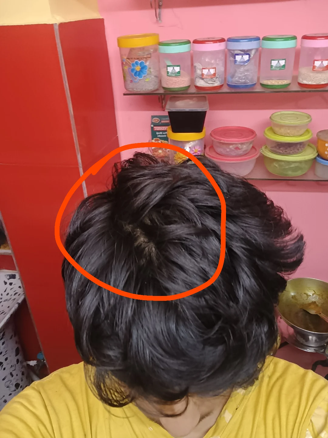 Is it Normal? | Scrolller