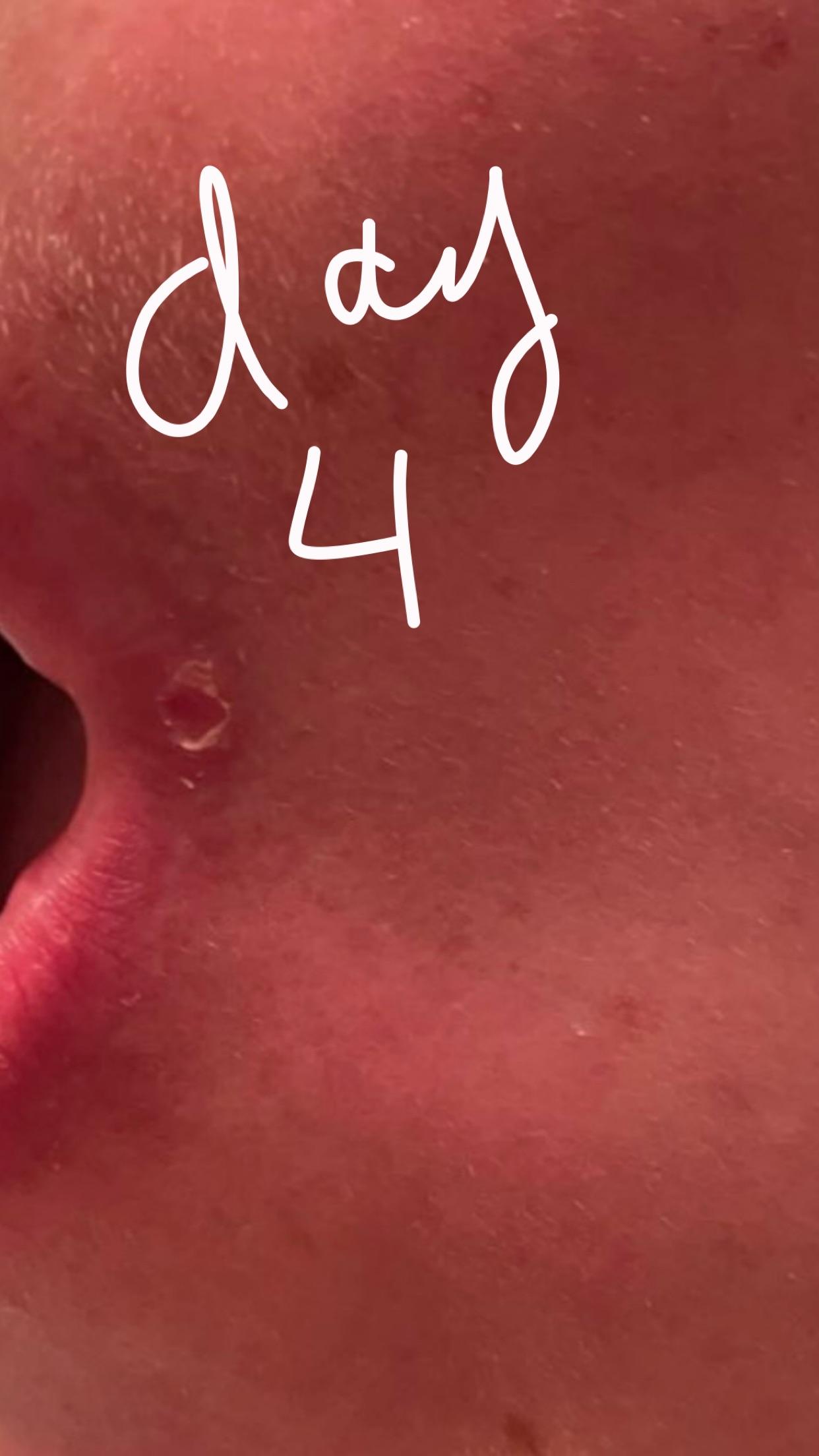 Cracked lip? | Scrolller