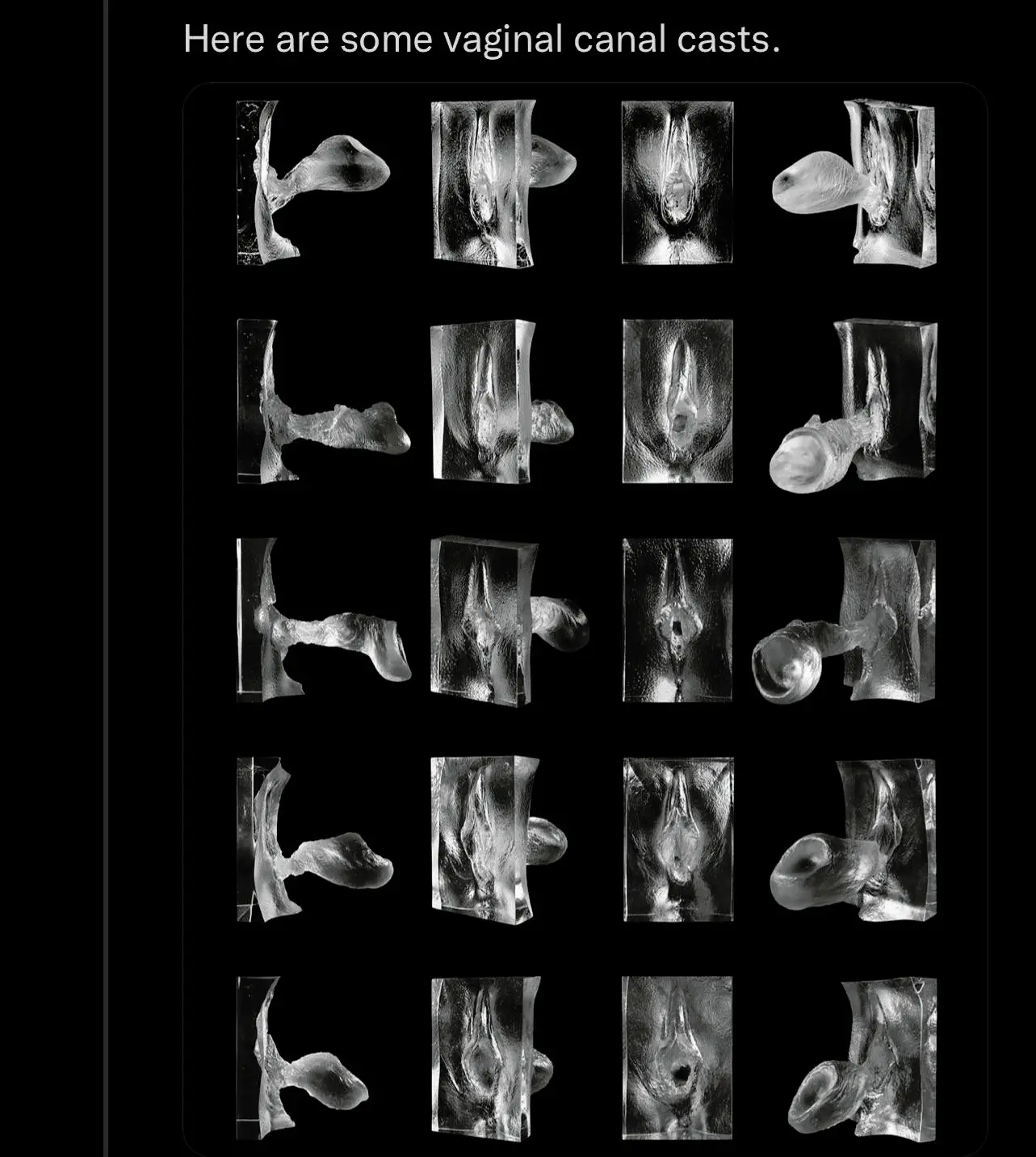 Different types of vaginal canals | Scrolller