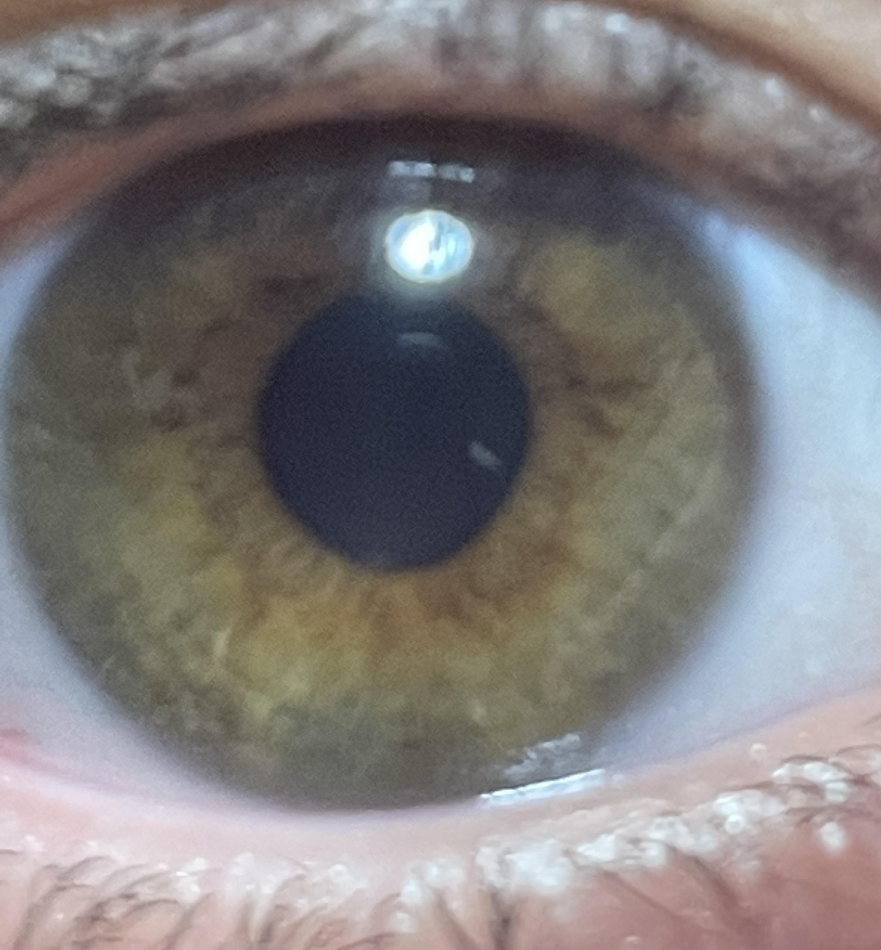 Are my eyes green, or hazel? | Scrolller