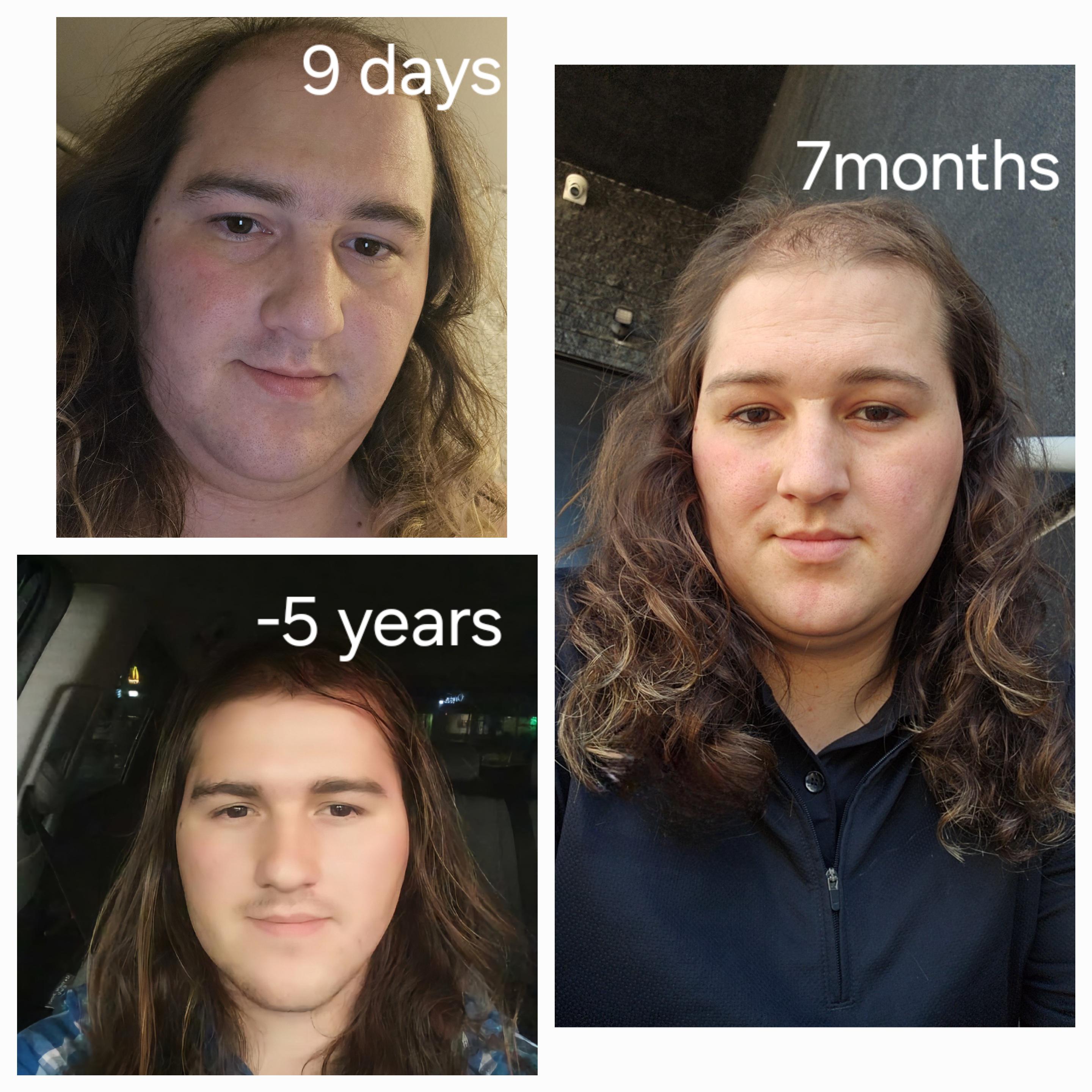 Does my face pass? Mtf | Scrolller