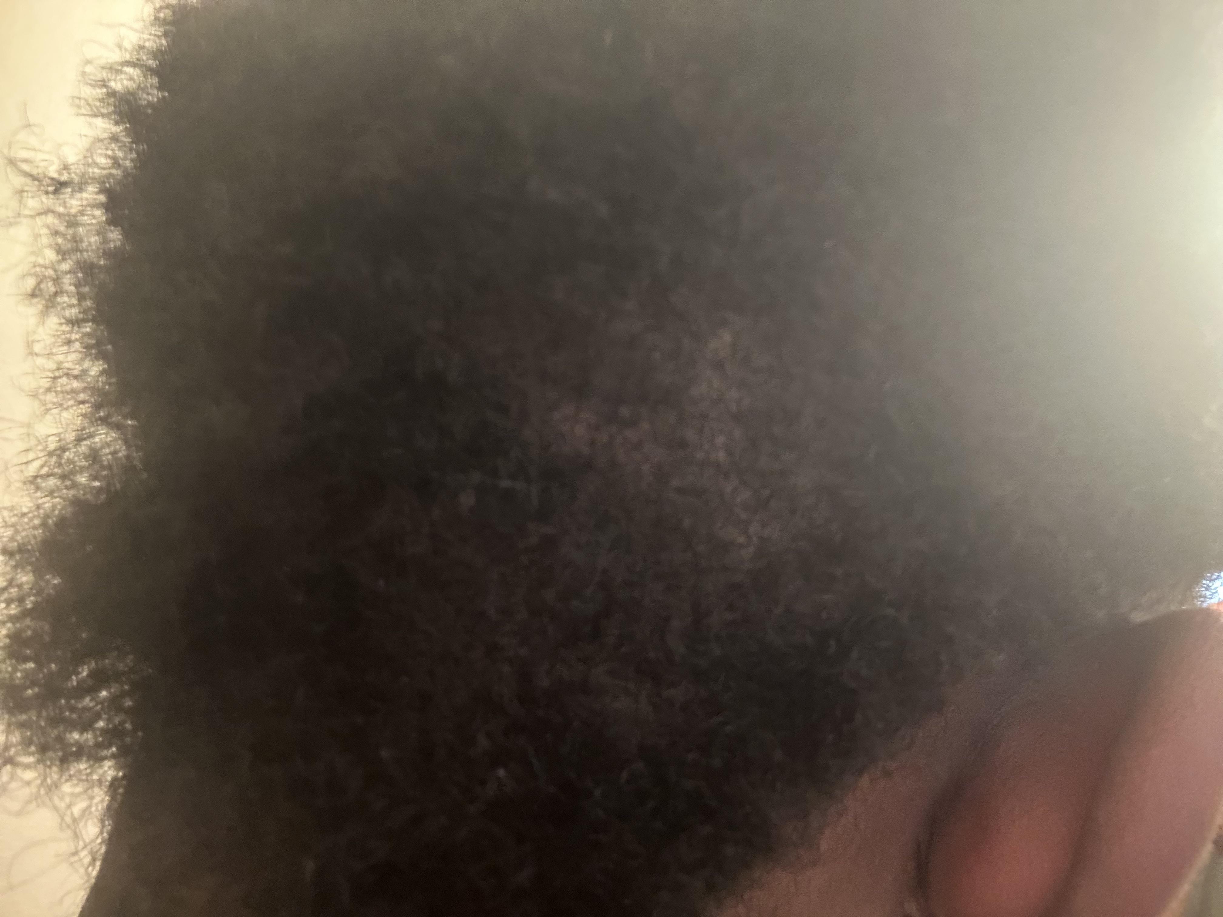 Bald spots | Scrolller