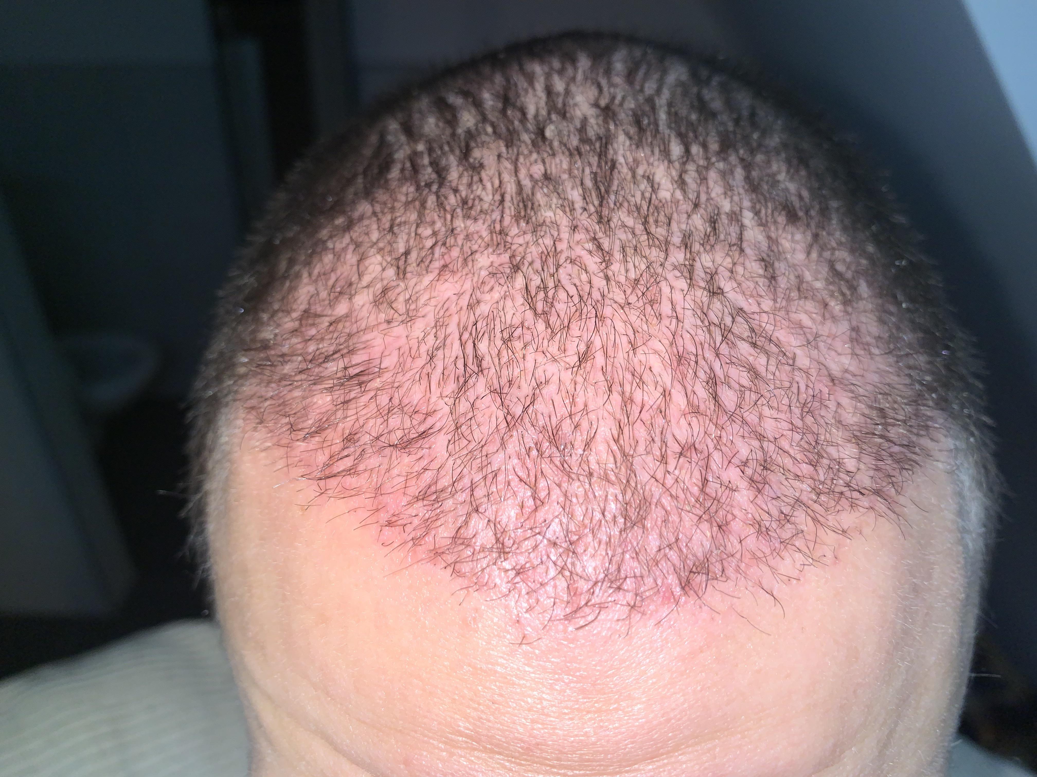 Is this the shadding phase? | Scrolller