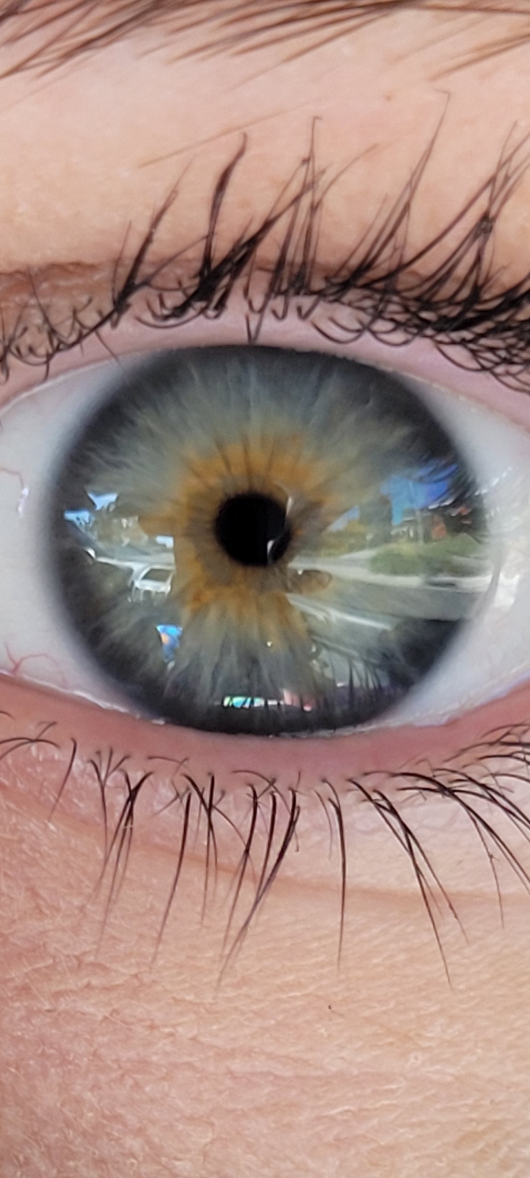 Central Heterochromia? | Scrolller