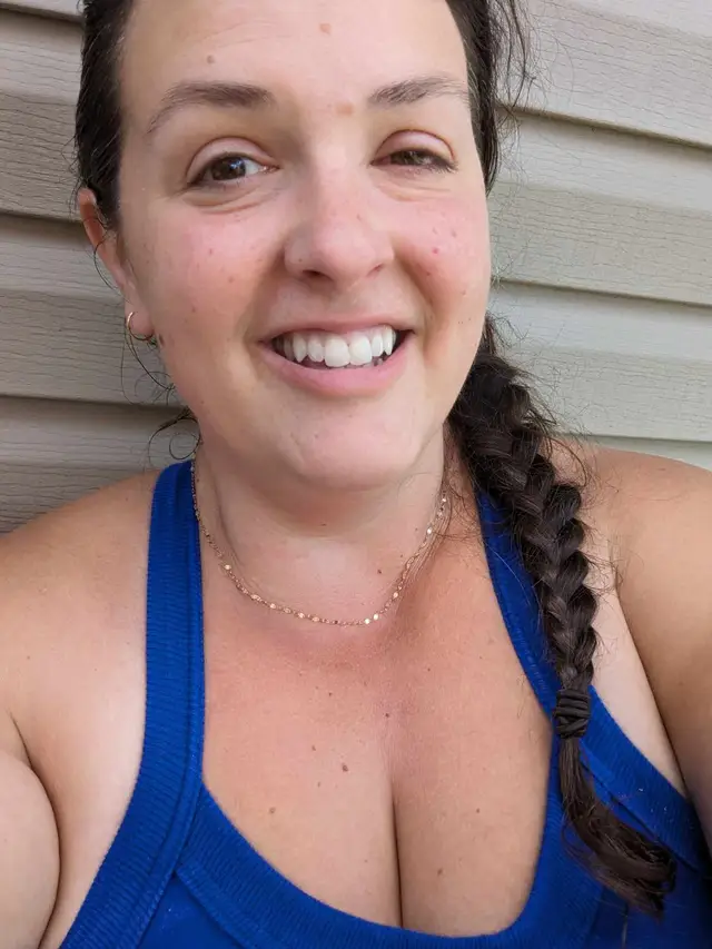 Yay! Eye is mostly better 🥰 35F | Scrolller