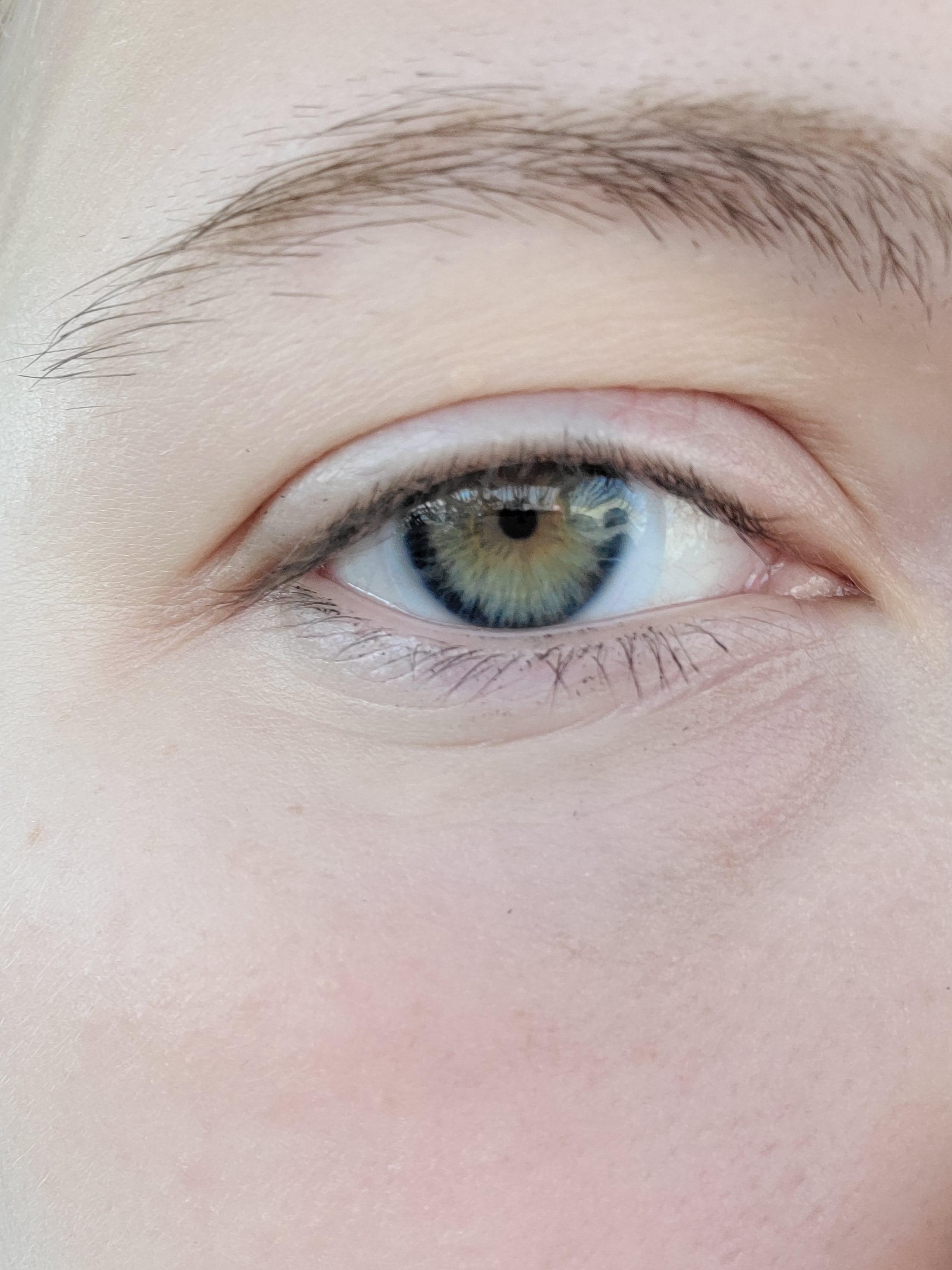 Is this some kinda heterochromia? Or is this considered hazel? | Scrolller