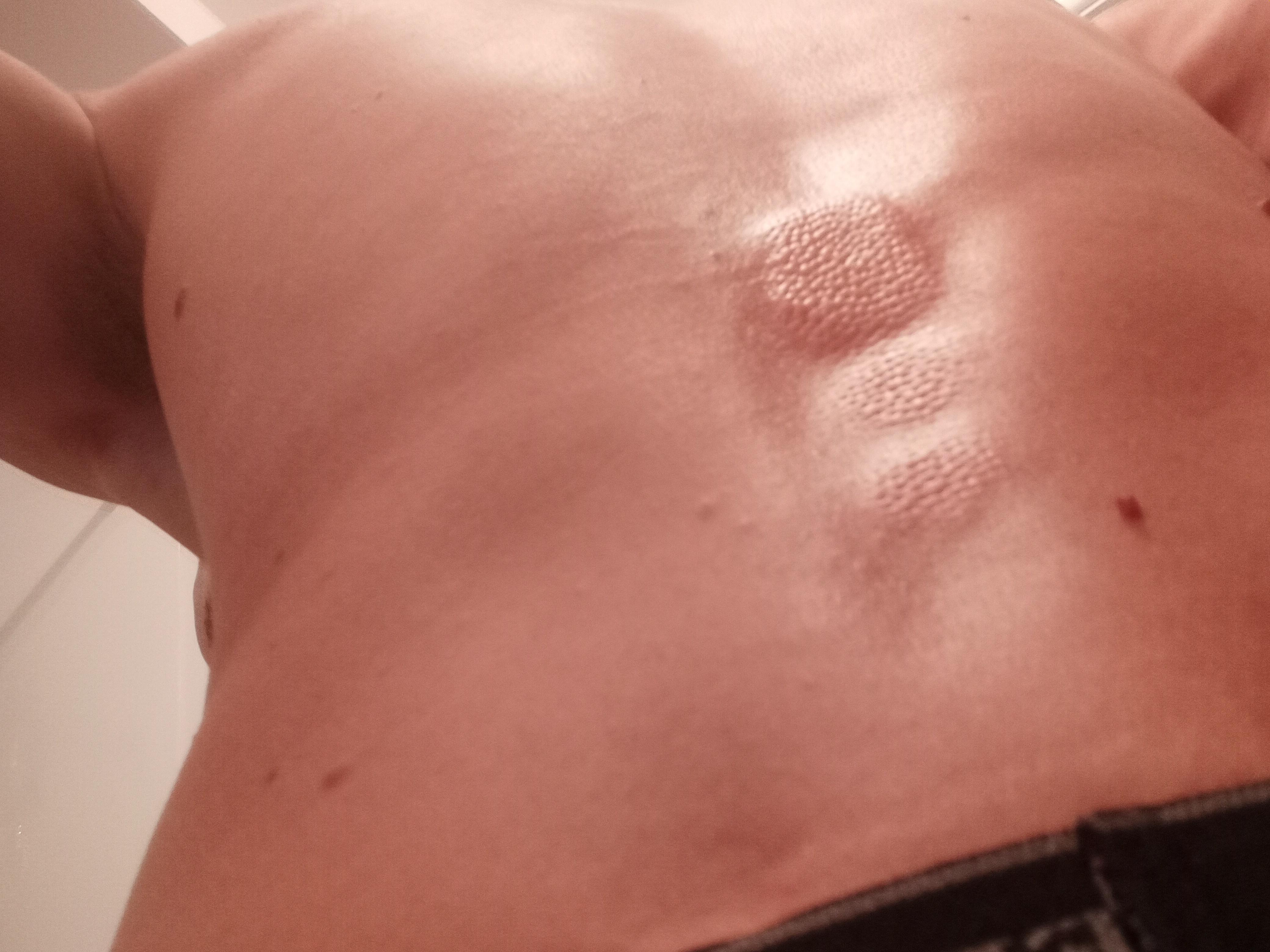 Itchy spot appeared on spine? | Scrolller