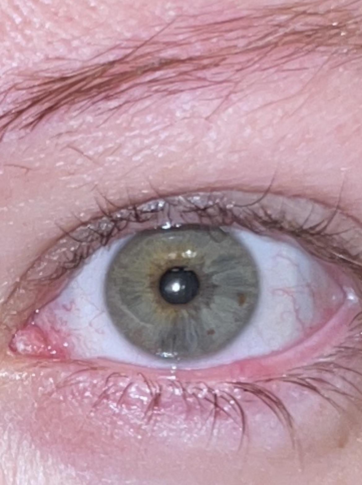 Brown spots? | Scrolller