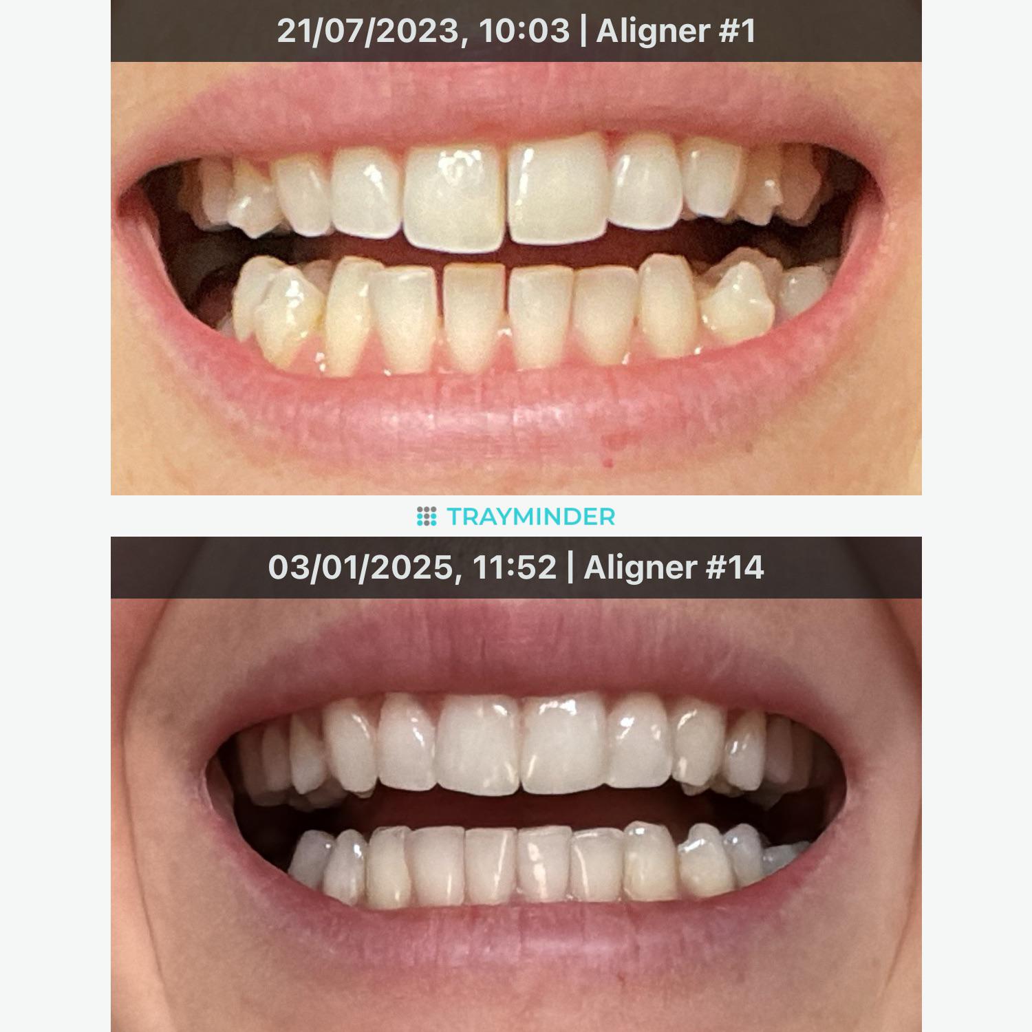 Finished! | Scrolller