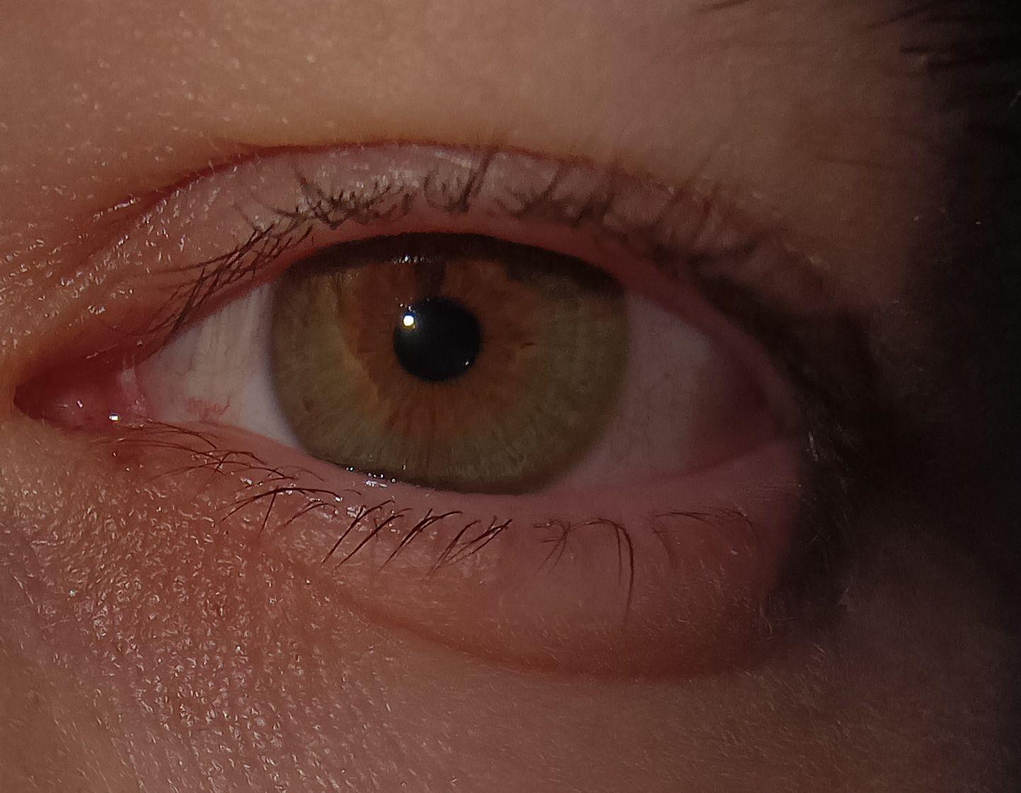 What color are my eys? I always thought they where green/hazel | Scrolller