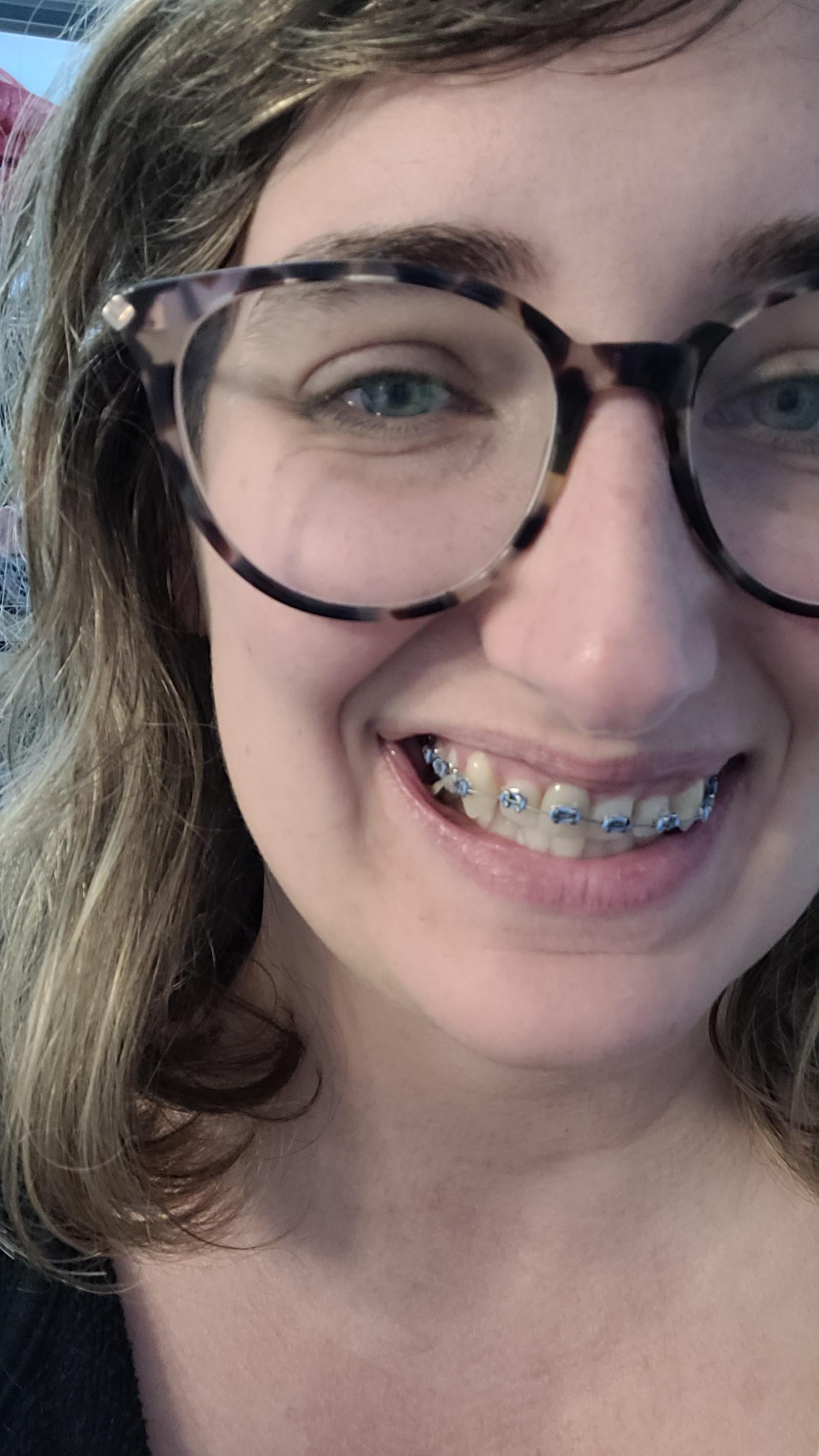 Day 1. Ow. | Scrolller