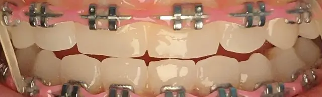 Midline is so close! | Scrolller