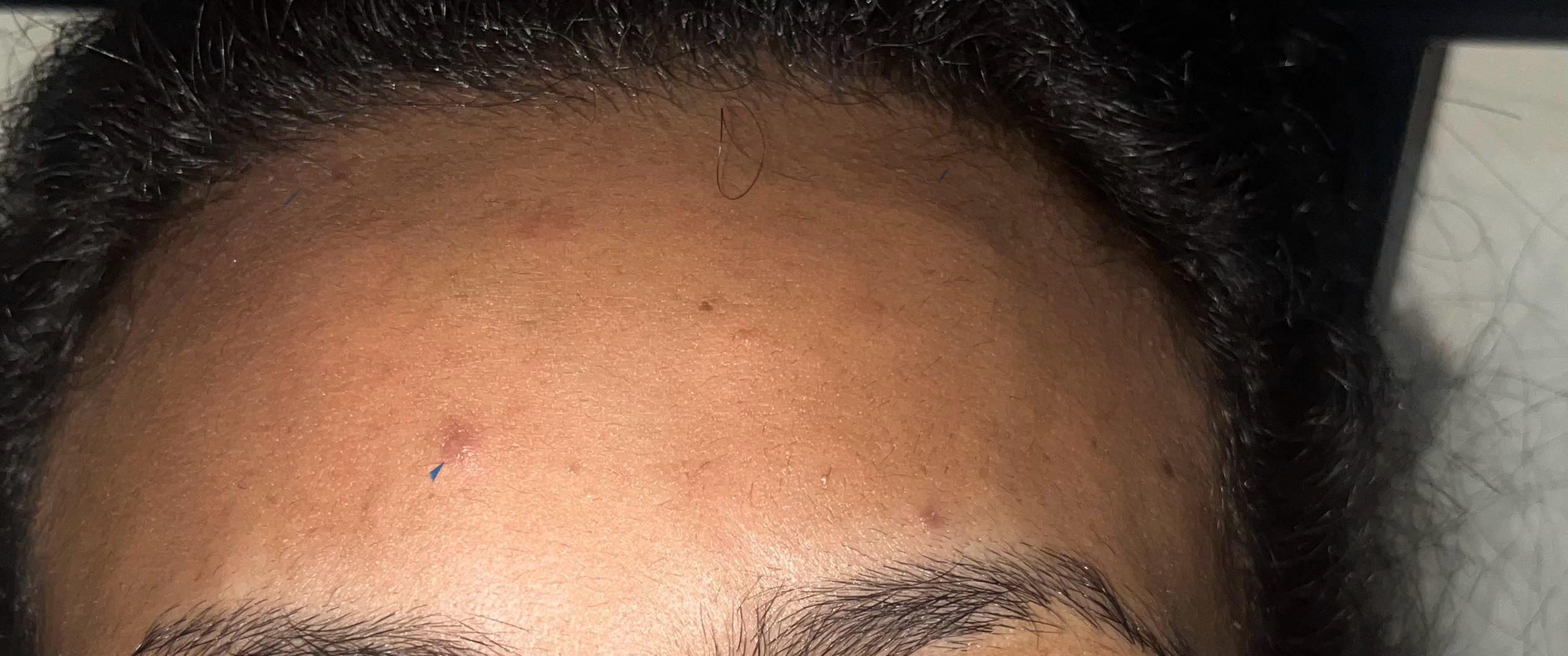 What are these weird pumps/elevations? They’re painful aswell | Scrolller