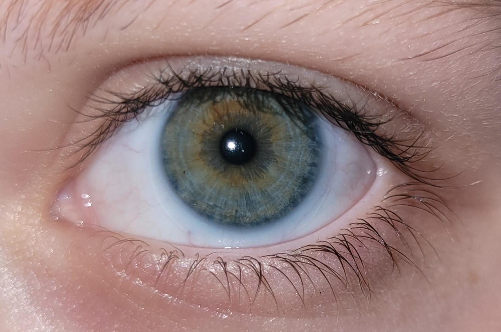 Blue? Hazel? Heterochromia? Green? | Scrolller