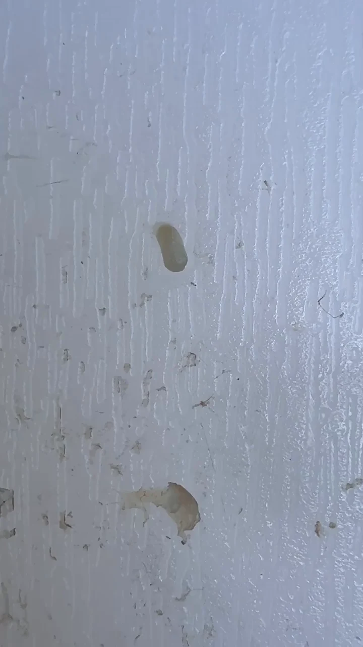 Skipjack tuna parasite ID help | Scrolller