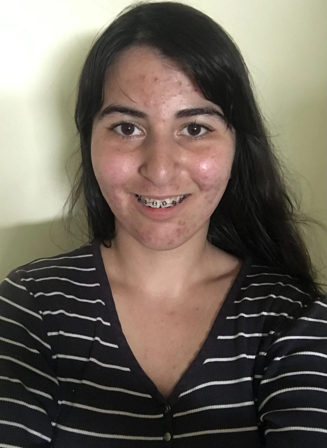 Journey has started! | Scrolller