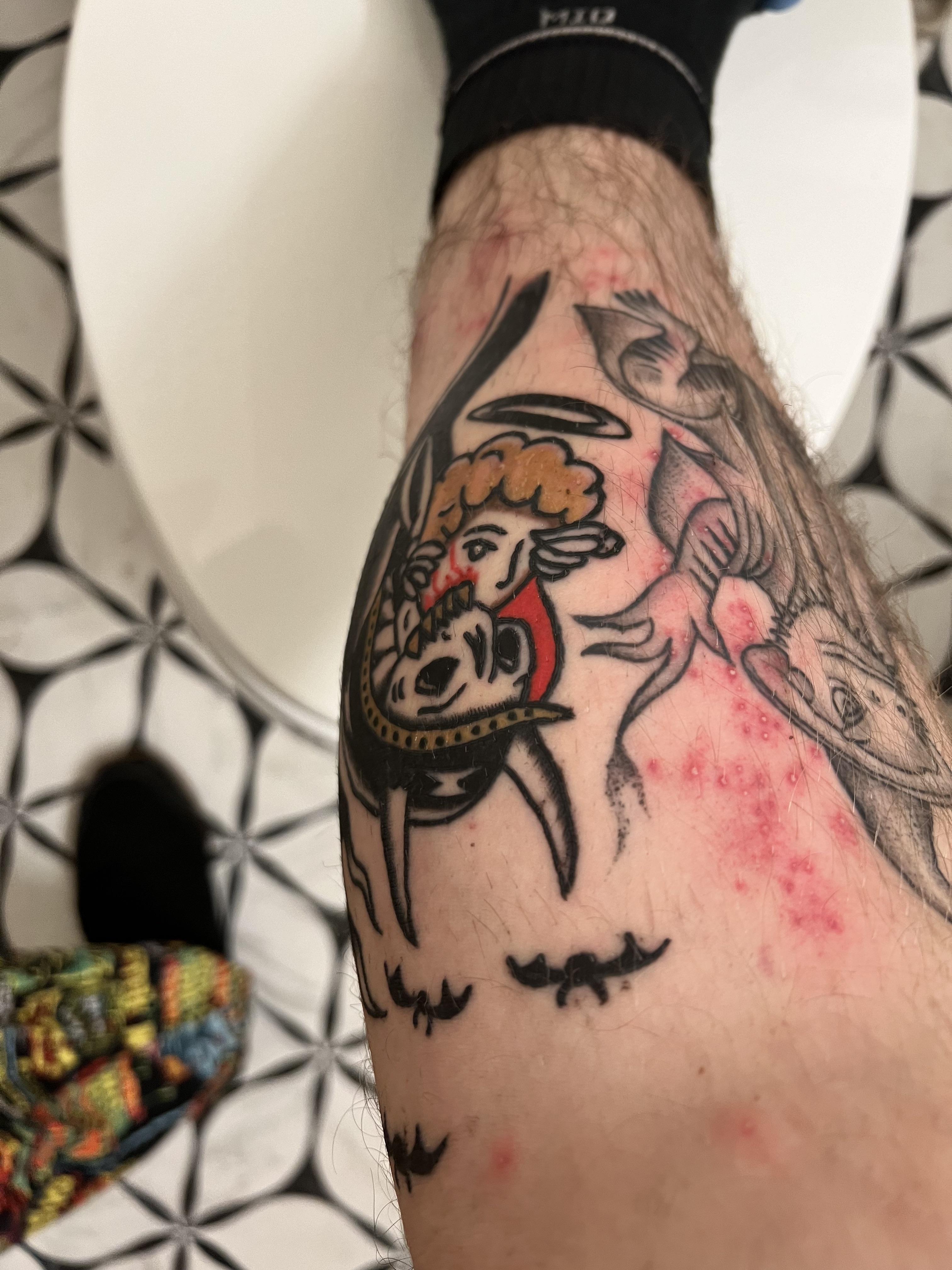 What are these red bumps that emerged after pulling off my second skin? | Scrolller