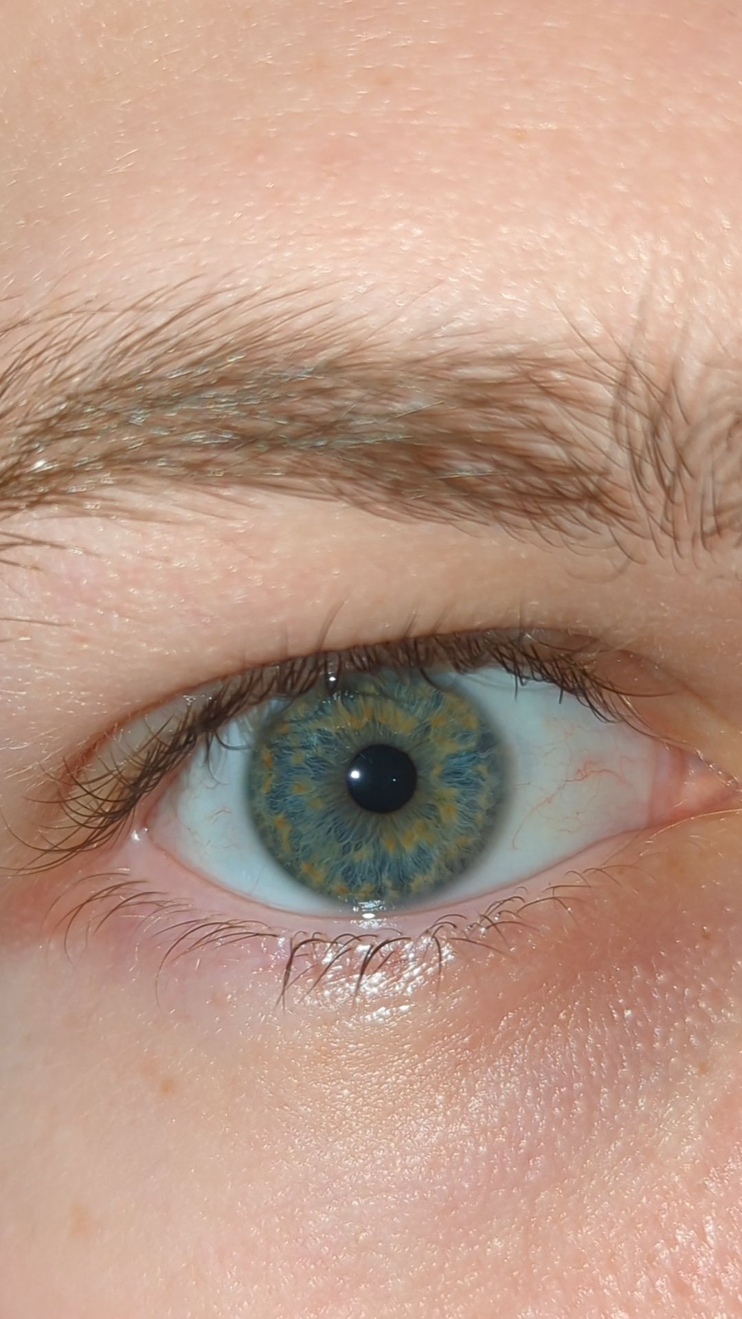 Eye pattern | Scrolller