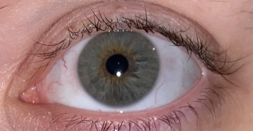 Grey? Green? Hazel? | Scrolller