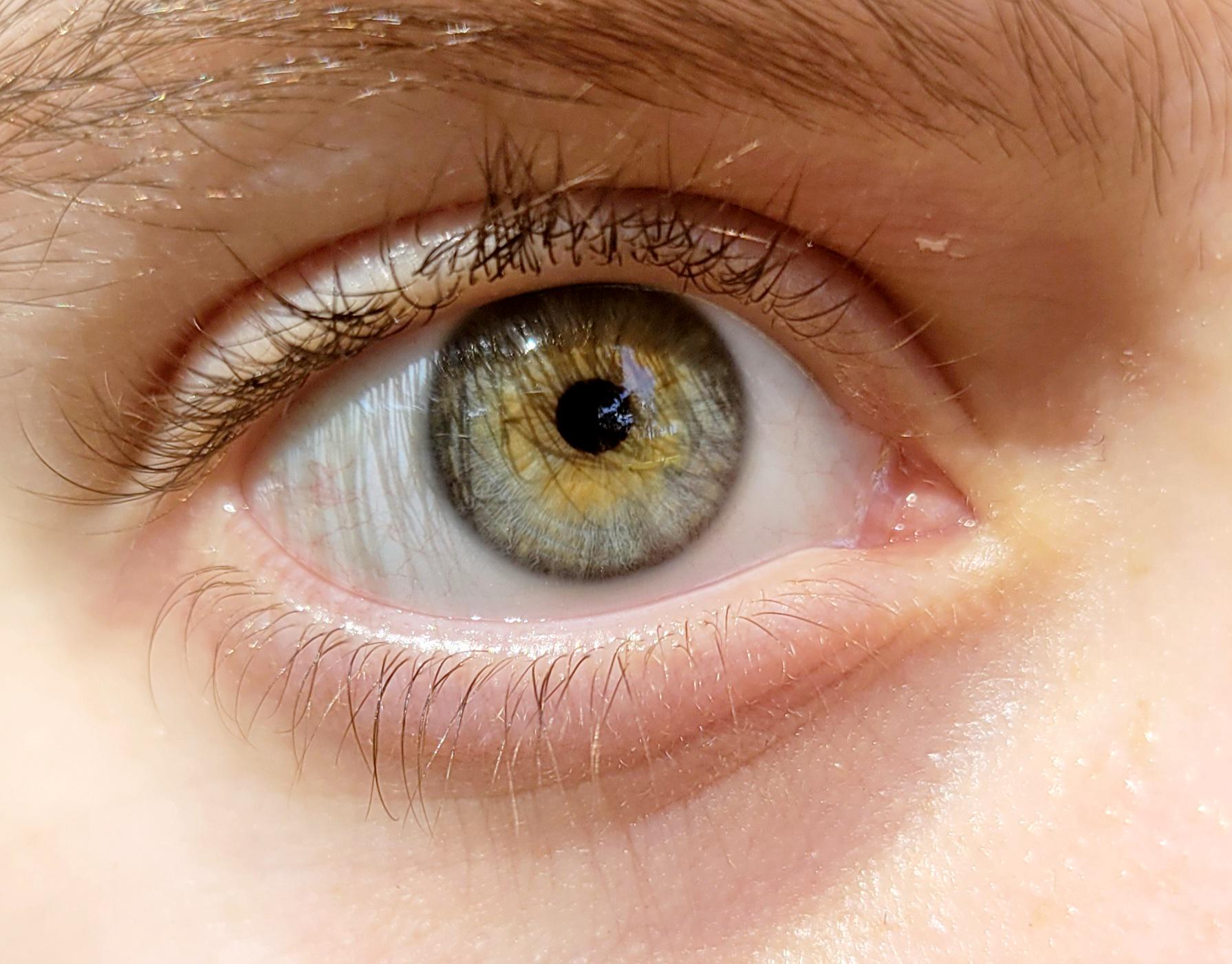 My peepers! | Scrolller